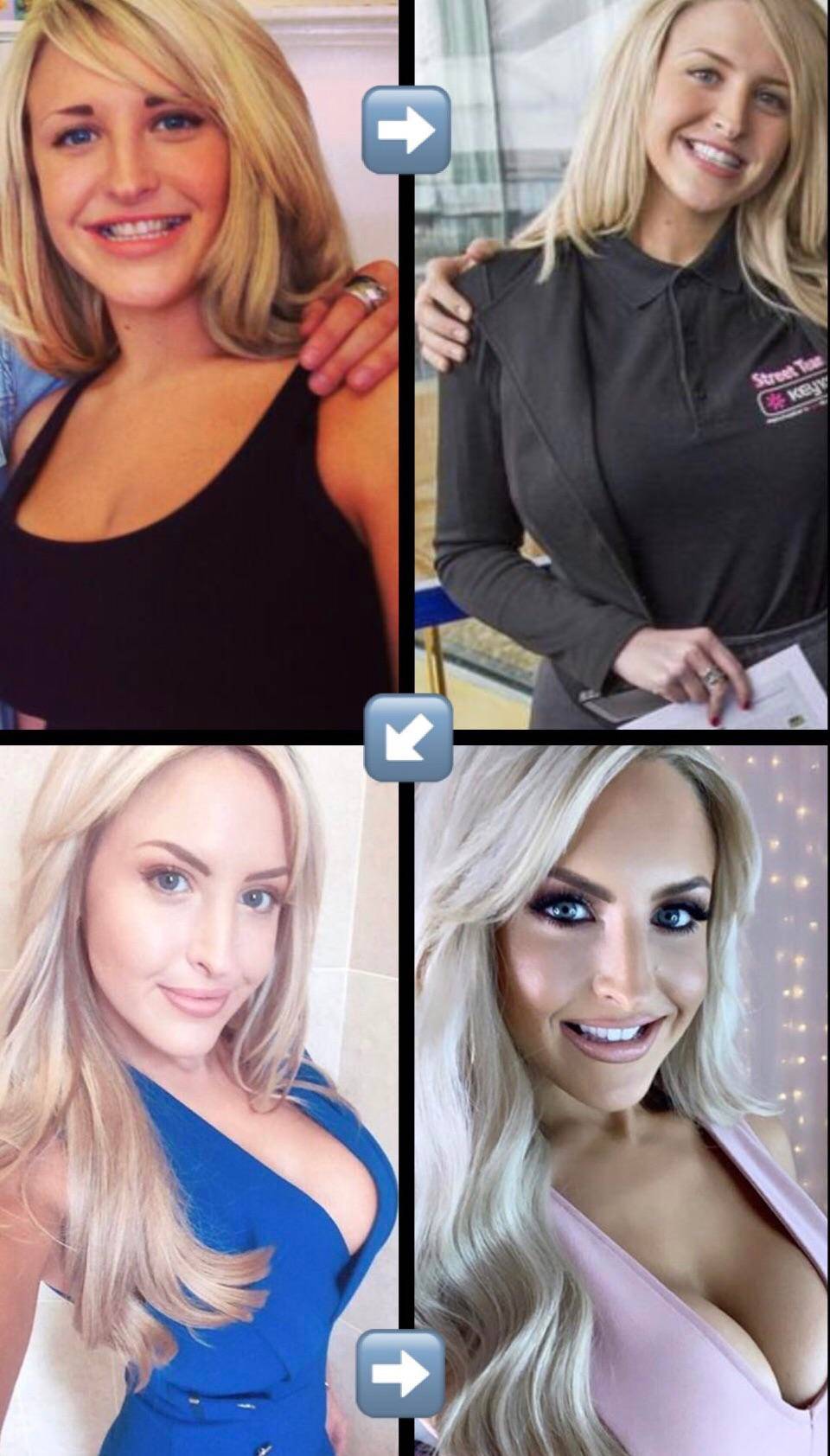 Emma Louise Jones transformation. | Scrolller