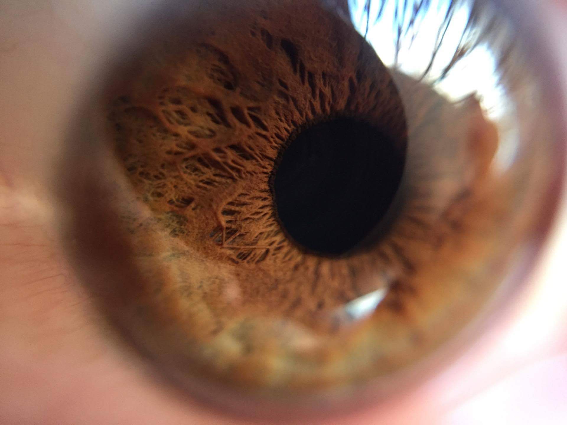 Eye, clip-on smartphone lens | Scrolller