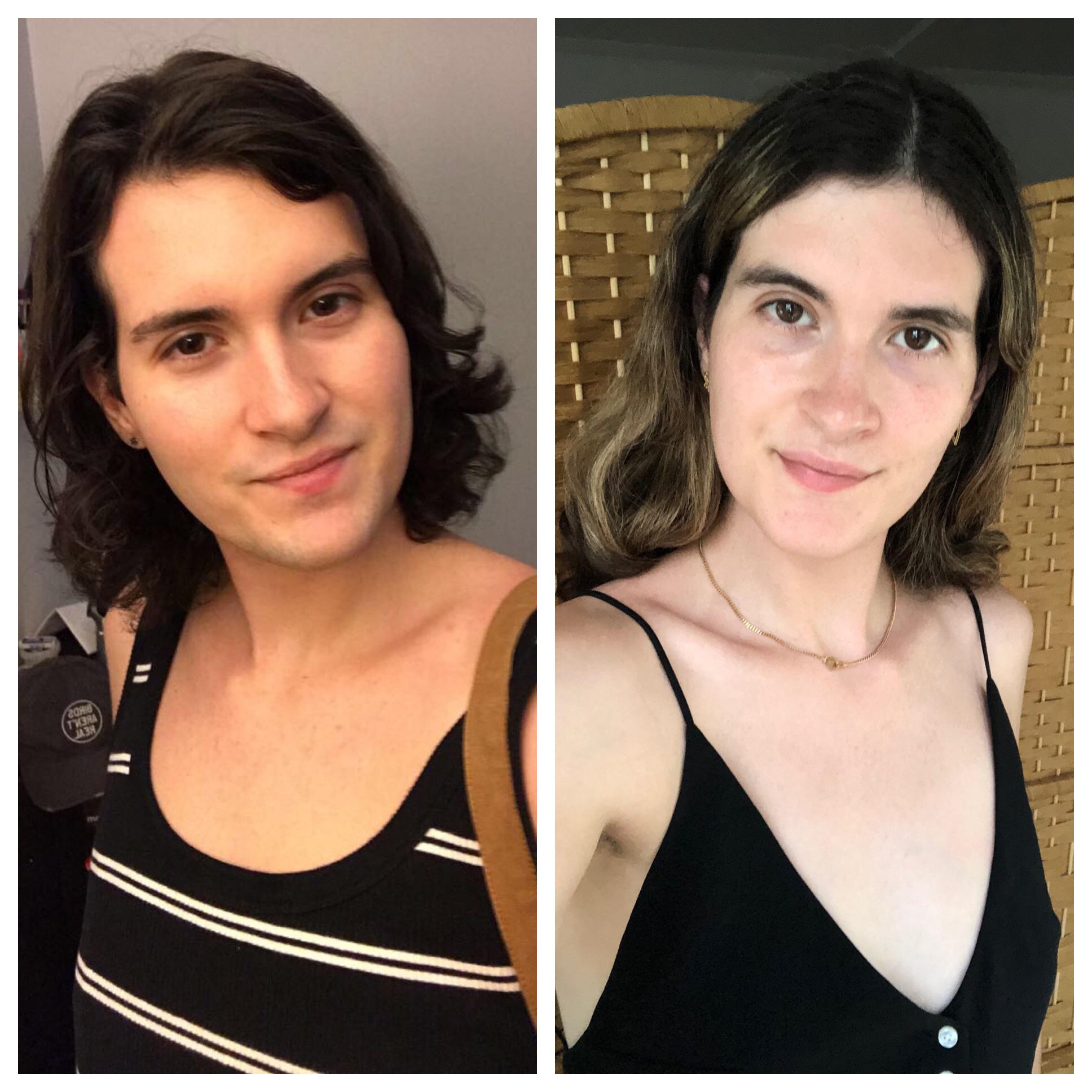 Facial changes from 2 months on hormones to 26, no FFS | Scrolller
