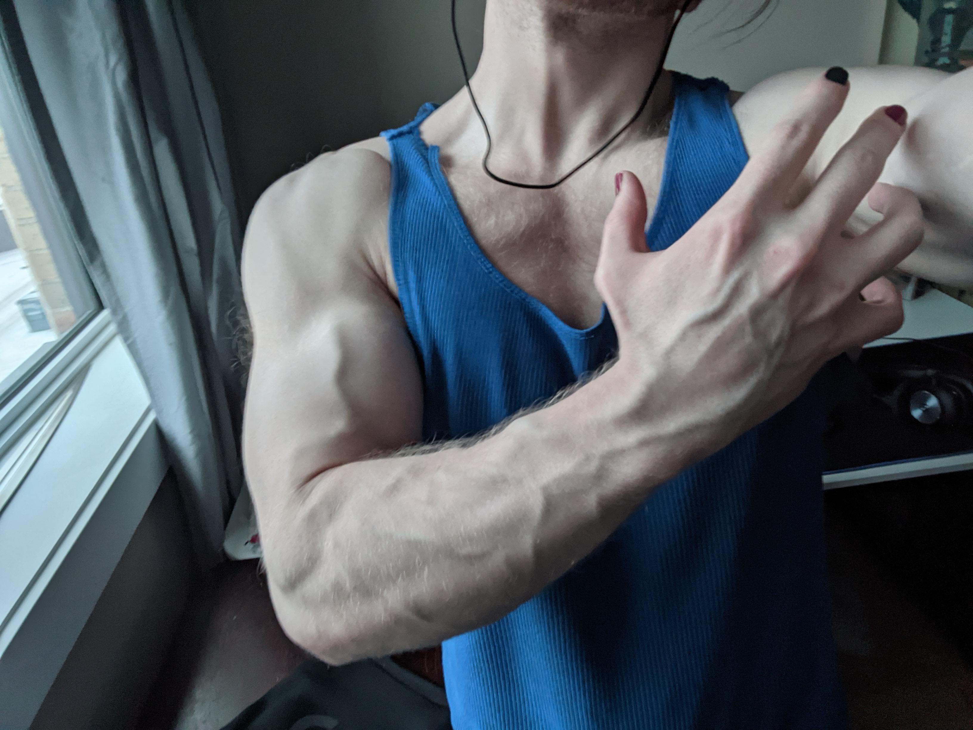 Feel my arm | Scrolller