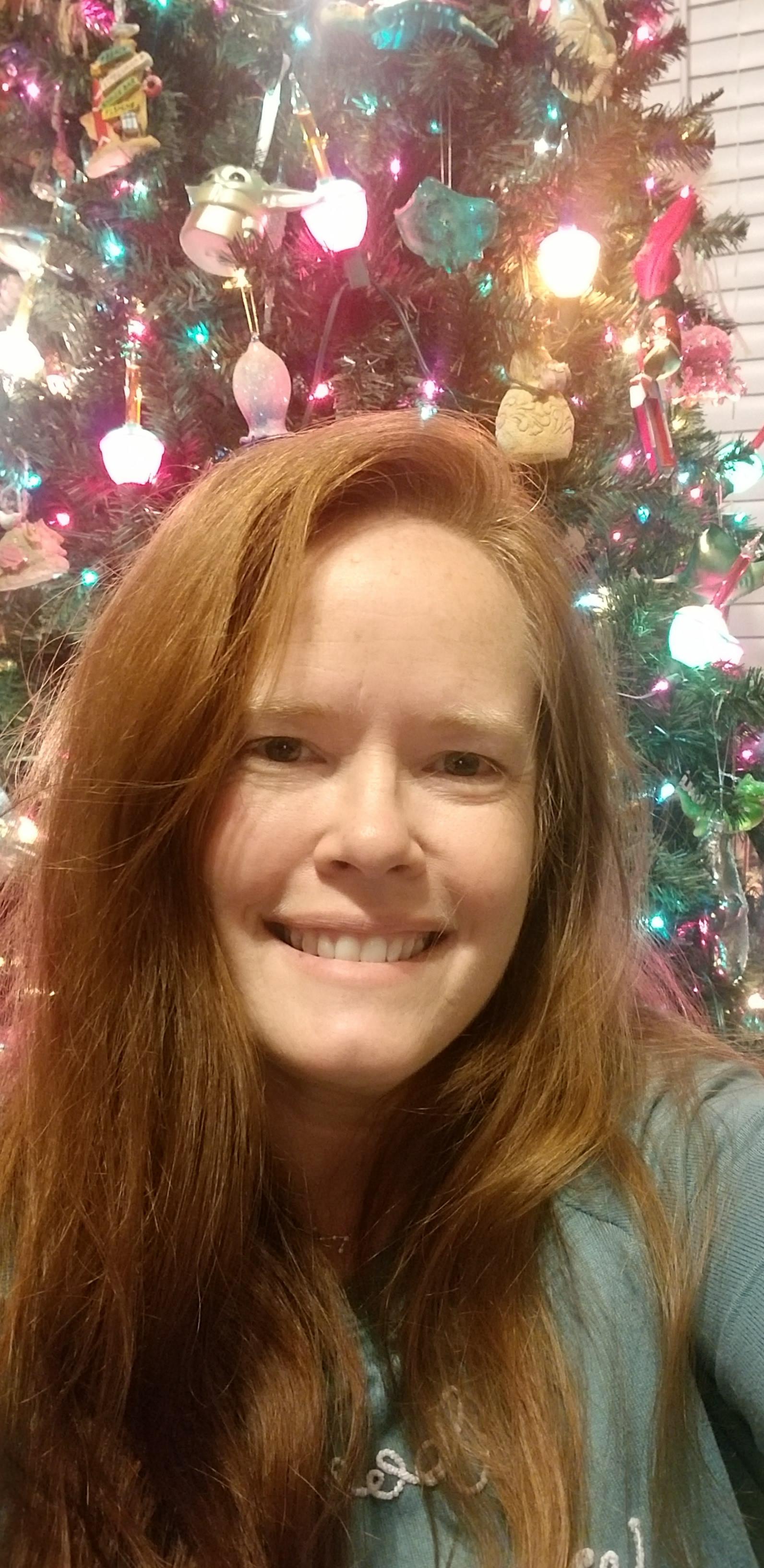 Feeling festive, do the Christmas lights bring out my freckles? | Scrolller