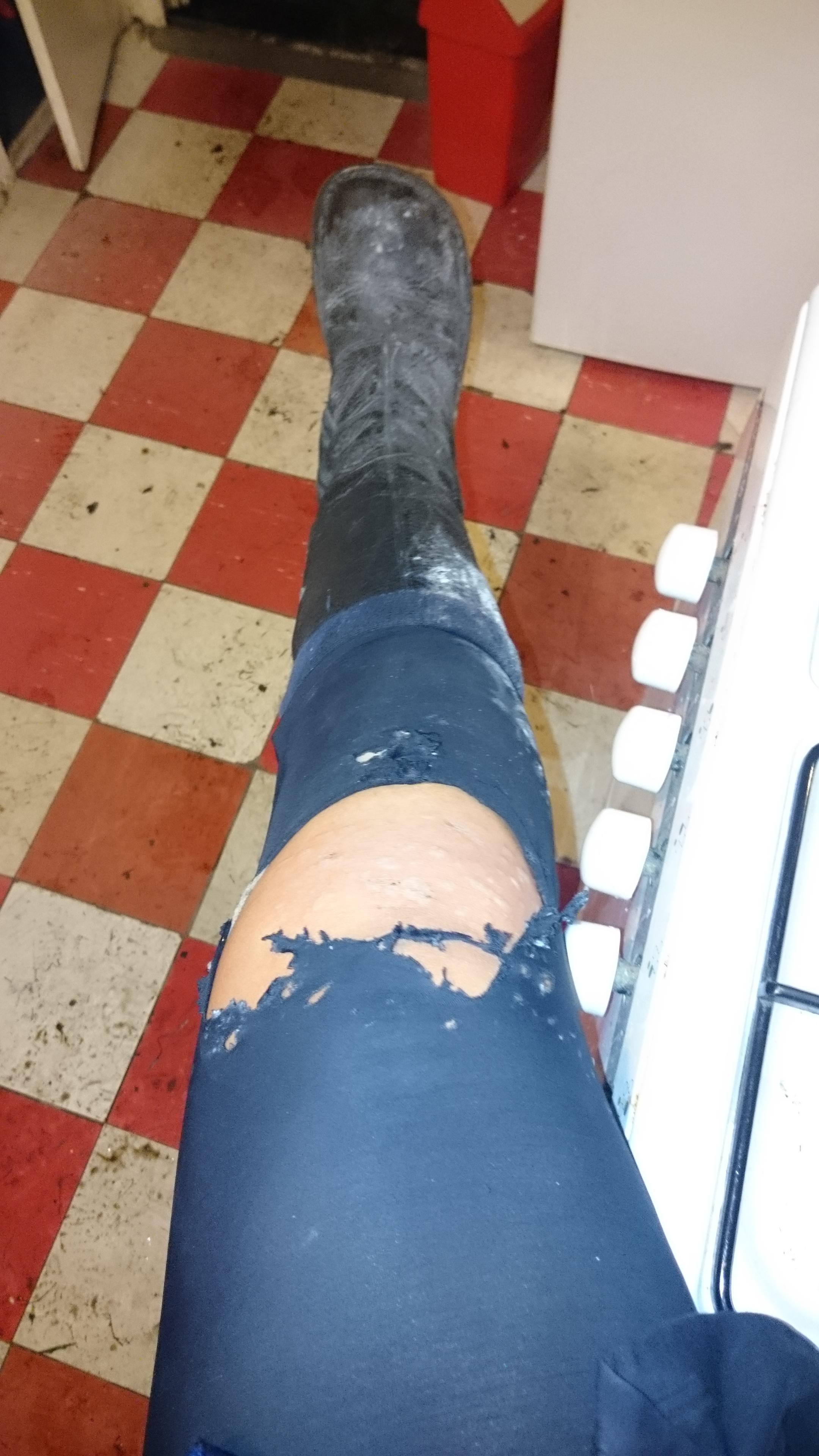 Fell into a bonfire.... Whoops... | Scrolller