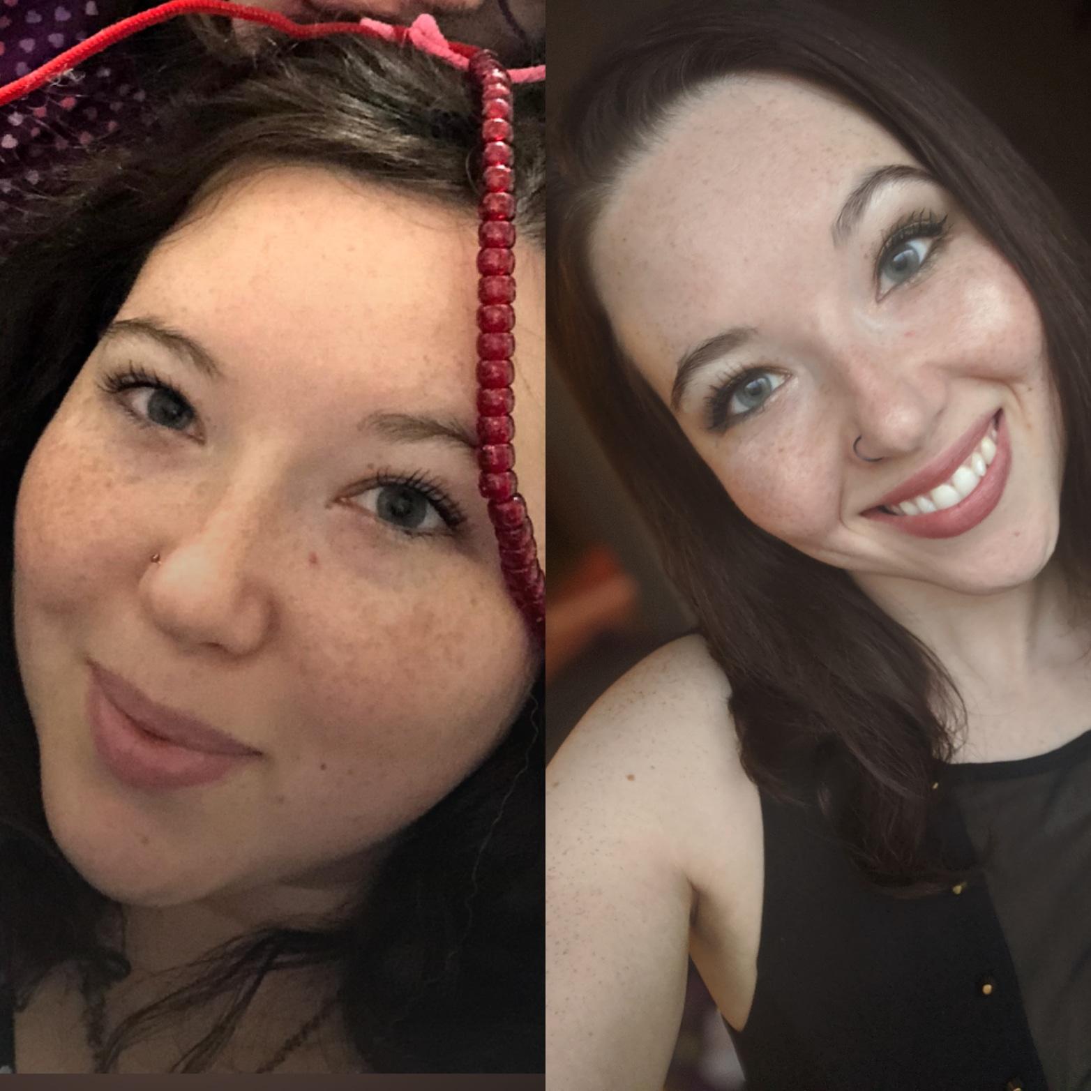 Fifty pounds dropped and my OCD* is finally satisfied. October 2018/ ... Fifty pounds dropped and my OCD* is finally satisfied. October 2018/ ...