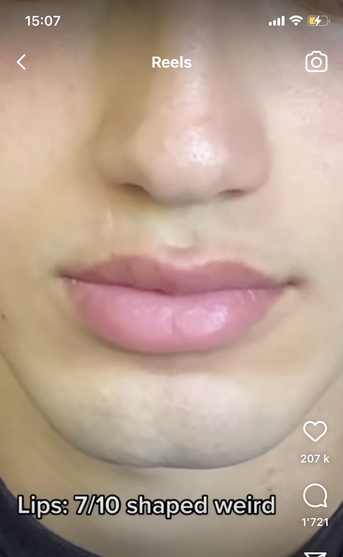 Filler moustache? | Scrolller