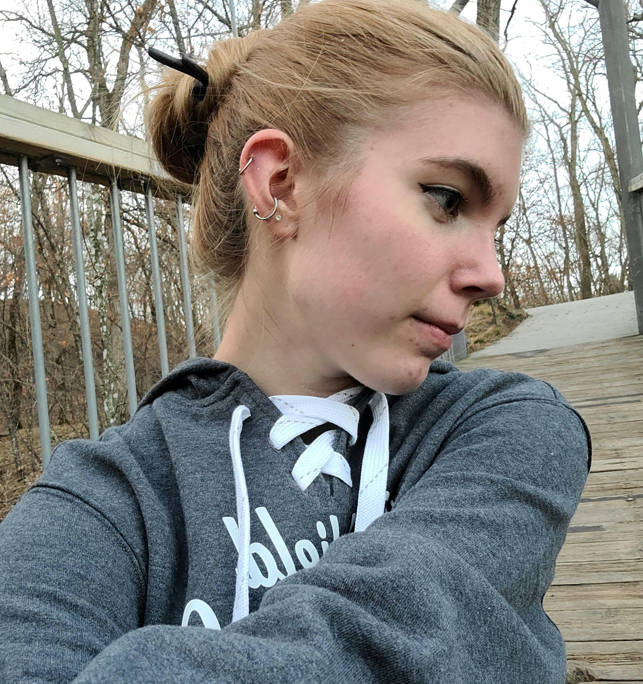 Finally ventured outside for the first time this week [20F] | Scrolller