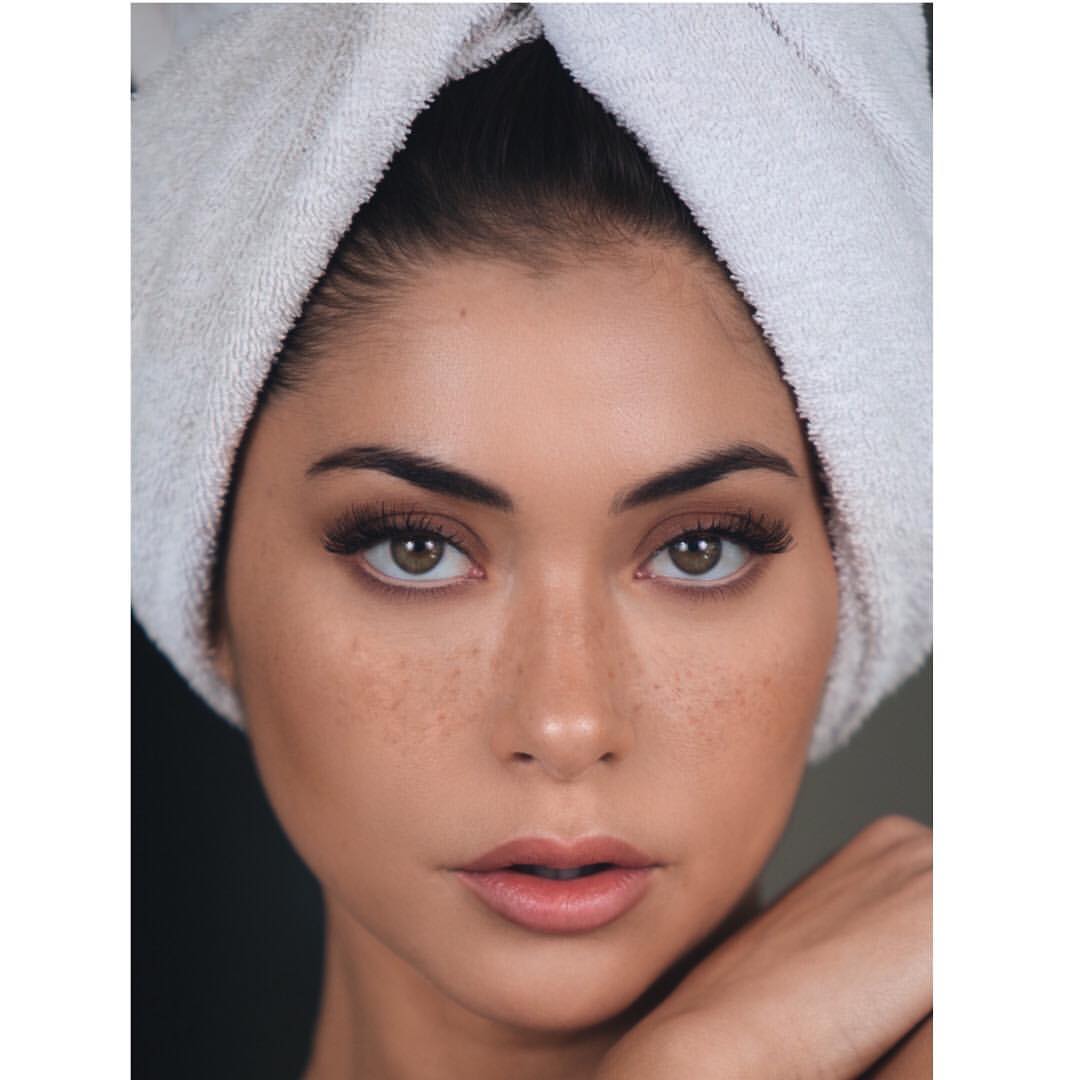 Freckle face | Scrolller