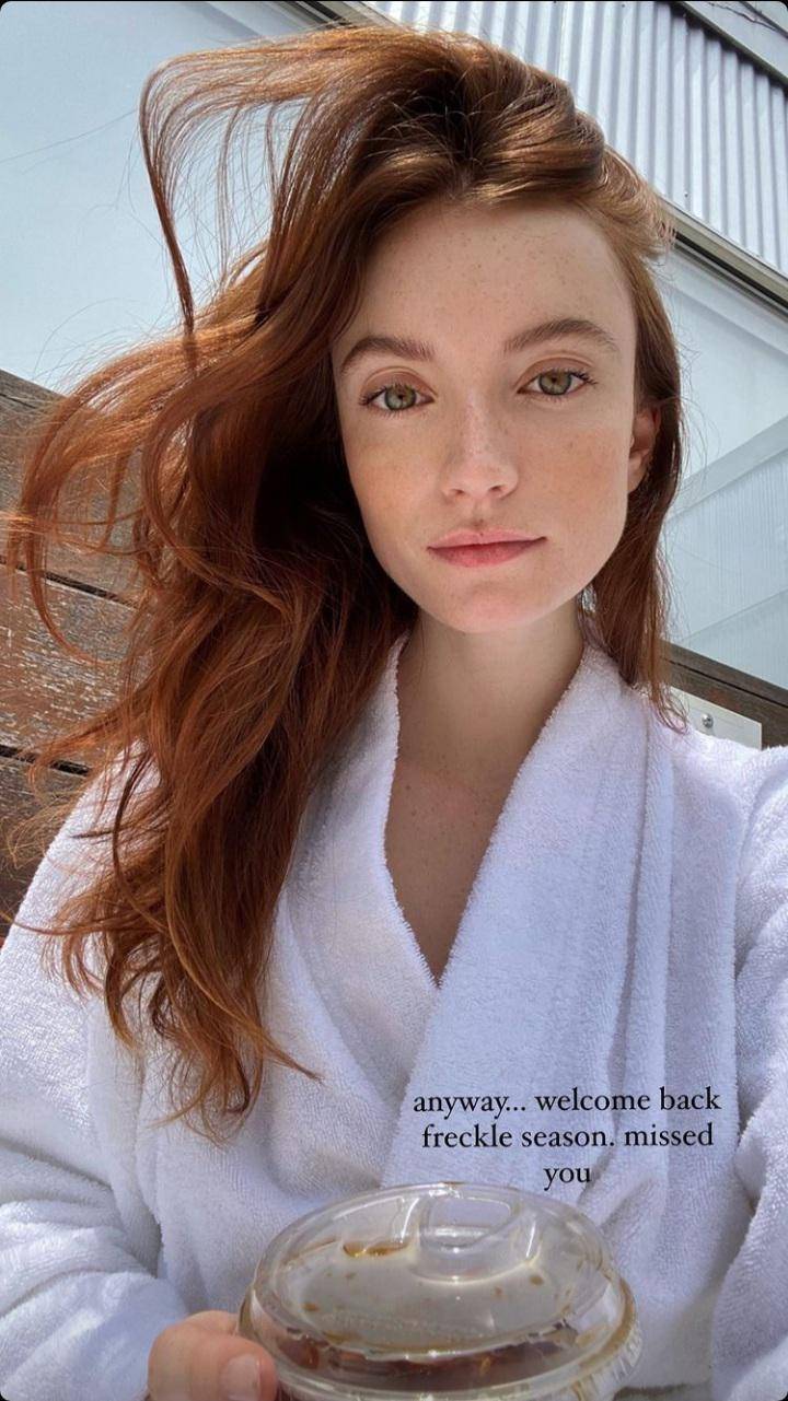 Freckle season | Scrolller