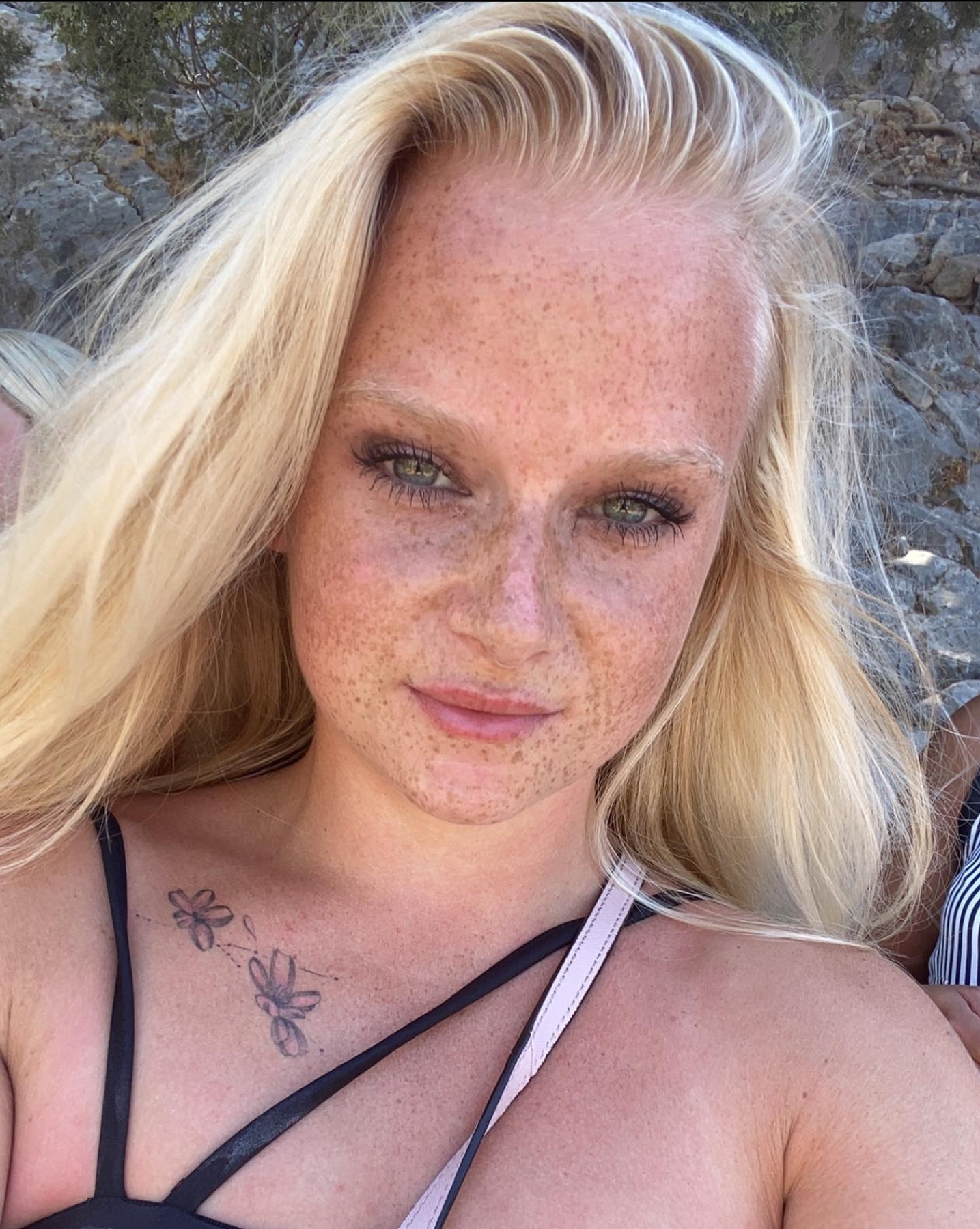 Freckled ::: Freckles ::: | Scrolller