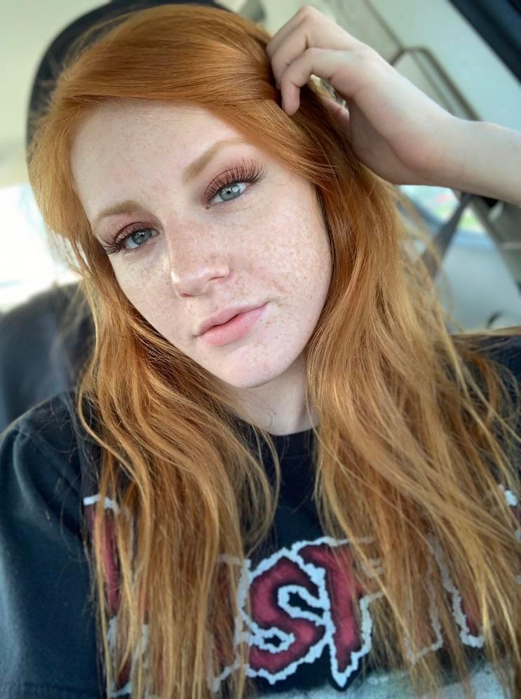 Freckles | Scrolller