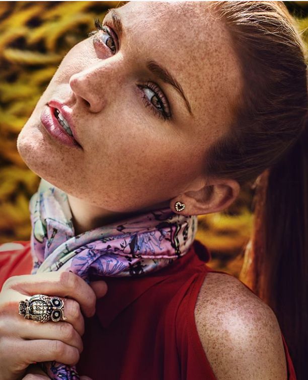 Freckles! | Scrolller