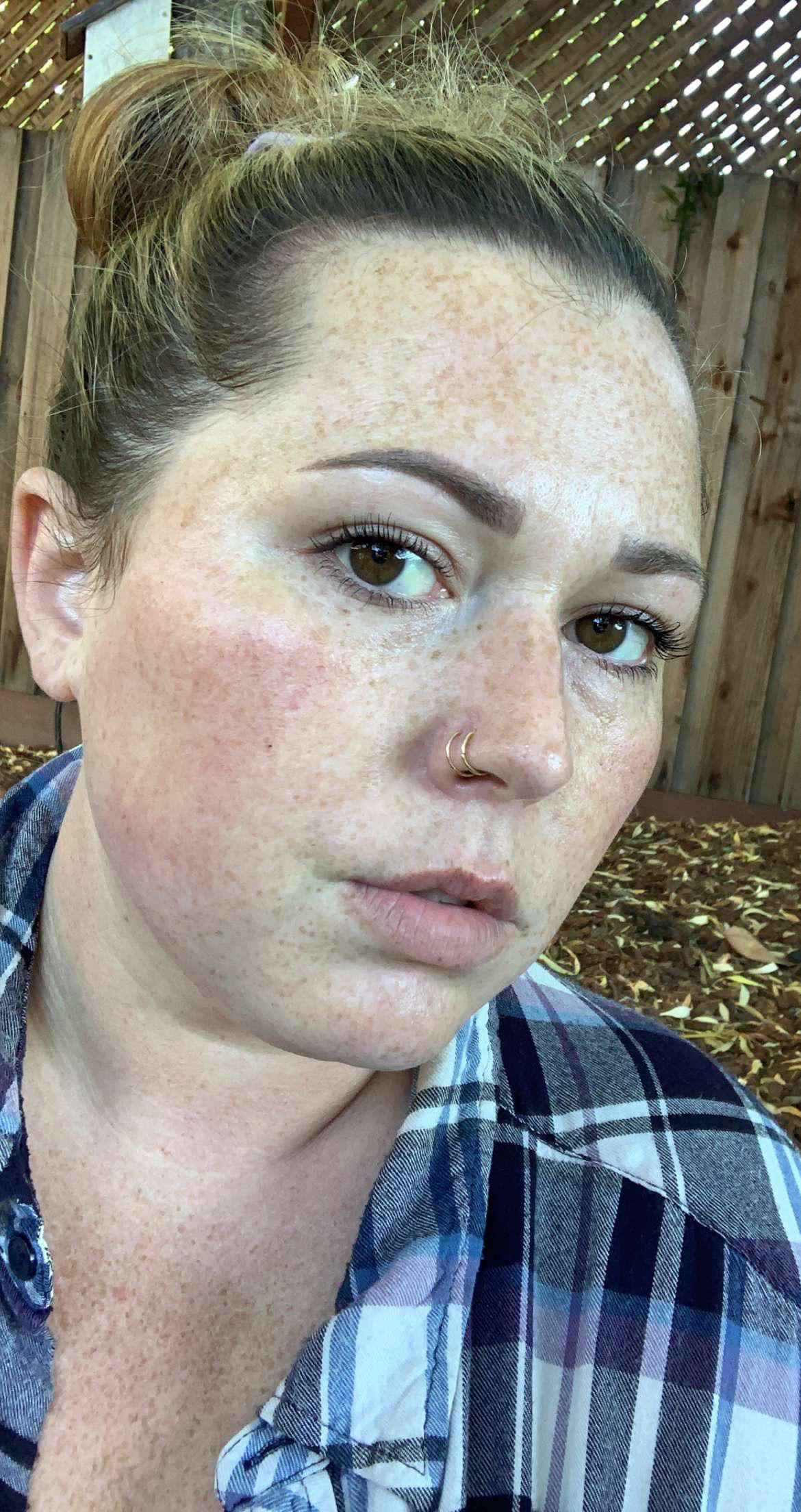 Freckles popping off today | Scrolller