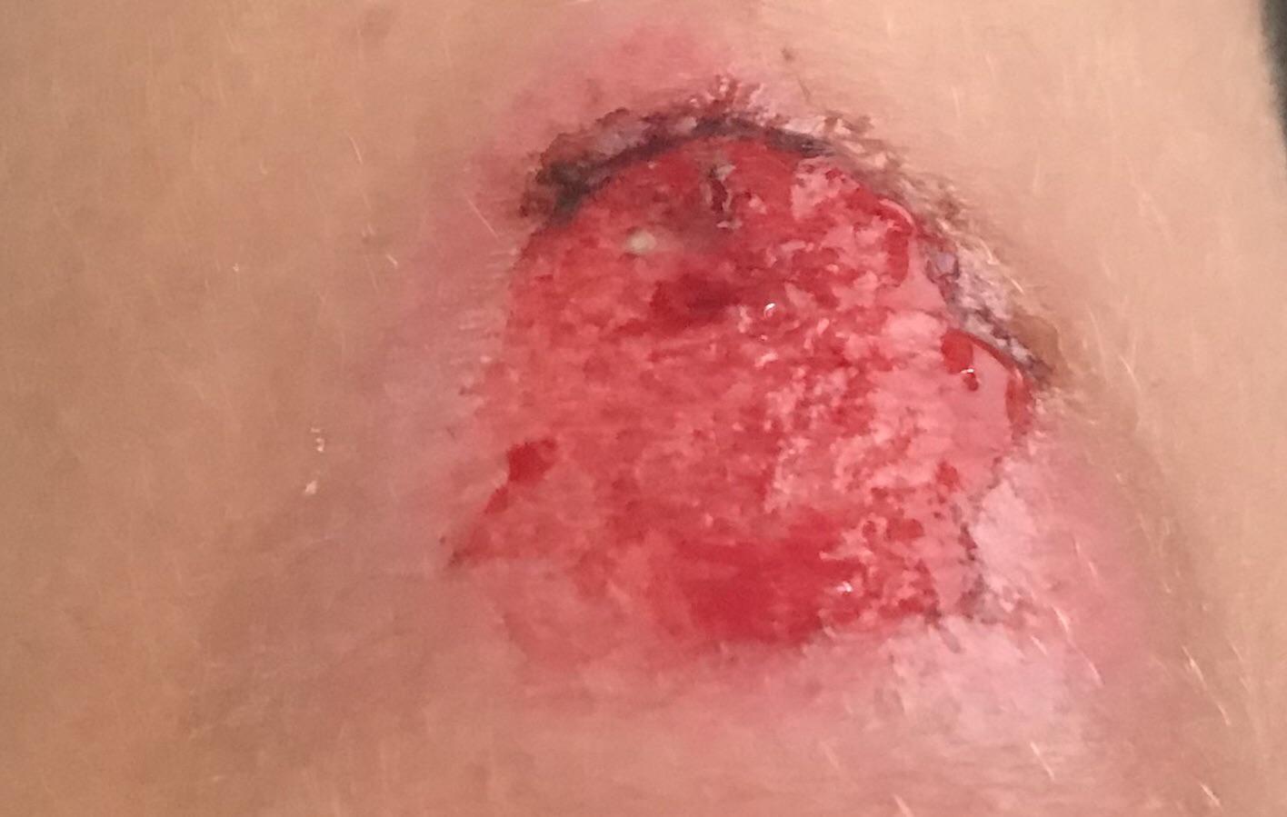 Fresh grass burn last night - how long til it recovers | Scrolller