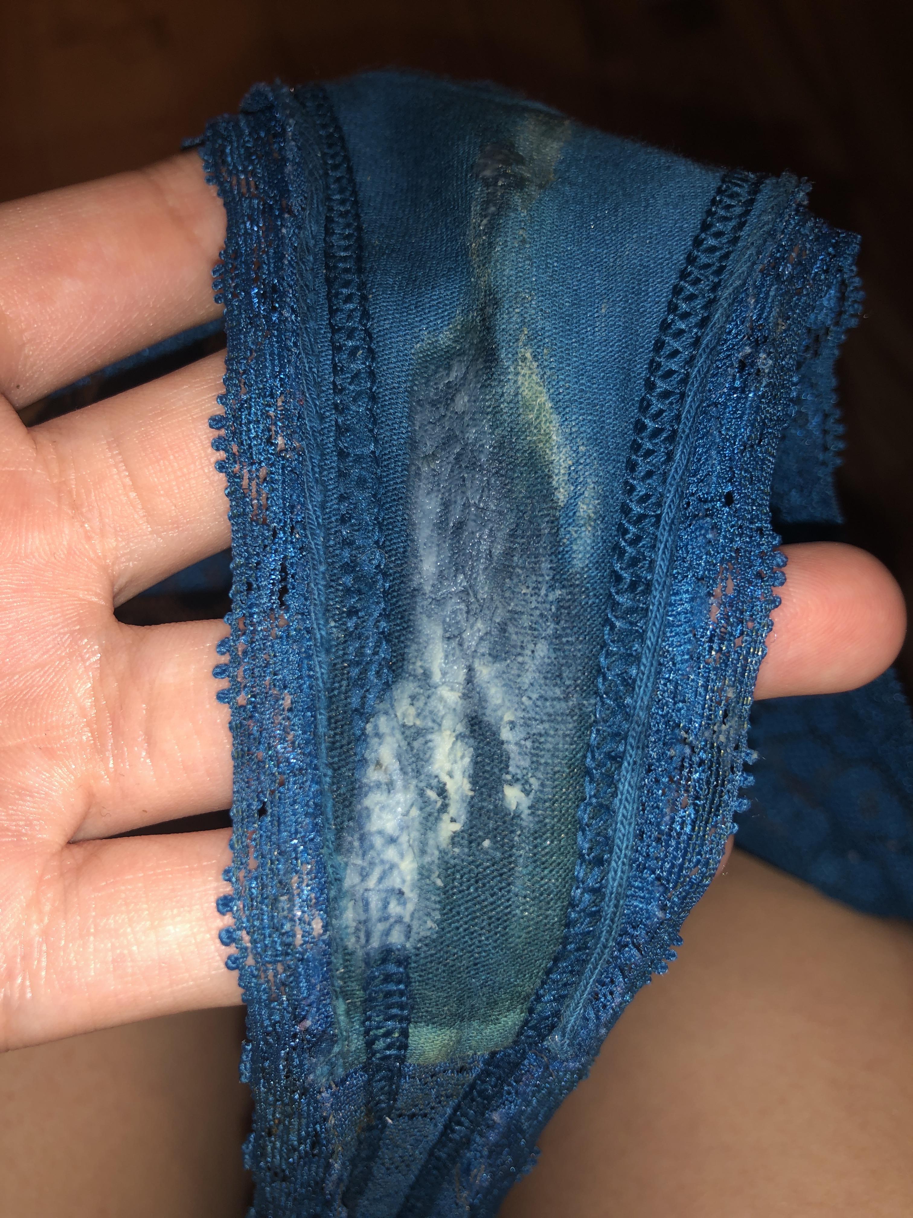 Freshly peeled! | Scrolller