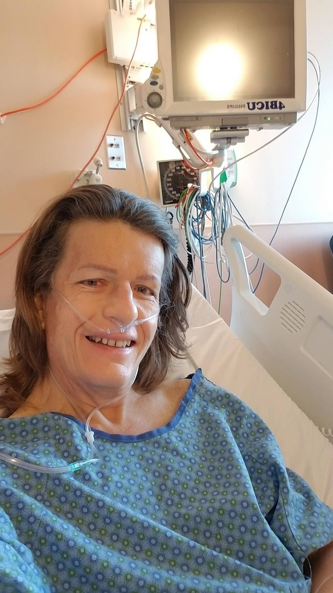 GCS went great. Surgeon said no problems. Feeling tired but no real pain.....yet. still can't ...