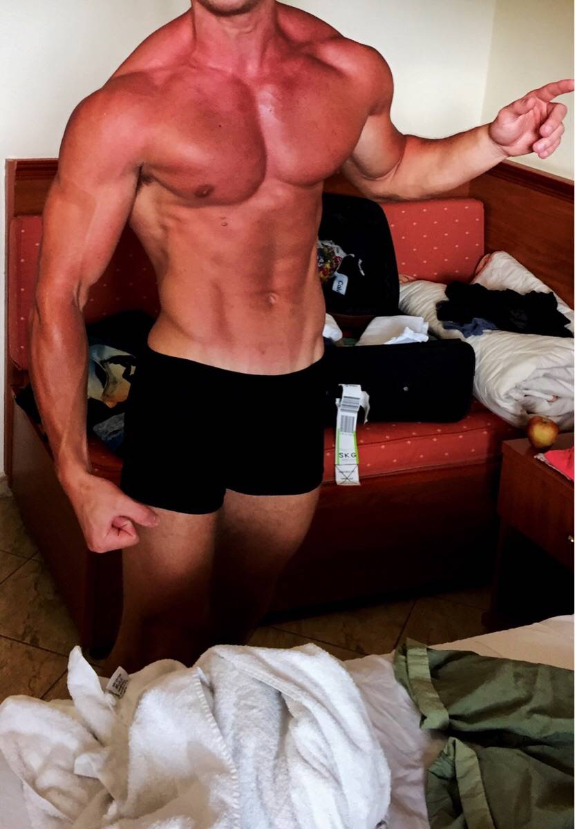 Got a little sunburn | Scrolller