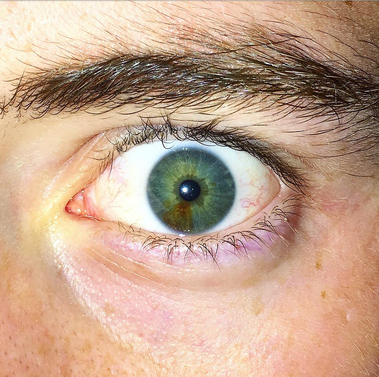 Green with bit of hazel. Only in my left eye. (: | Scrolller