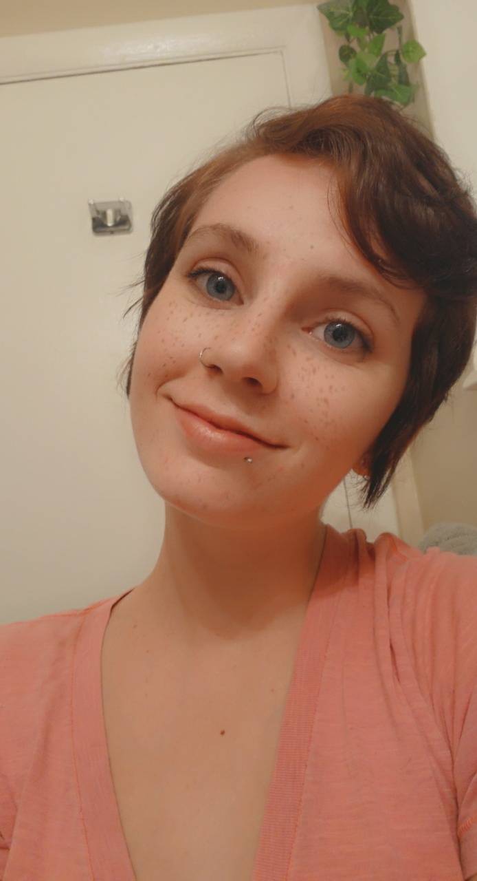 Growing out my shaved head | Scrolller