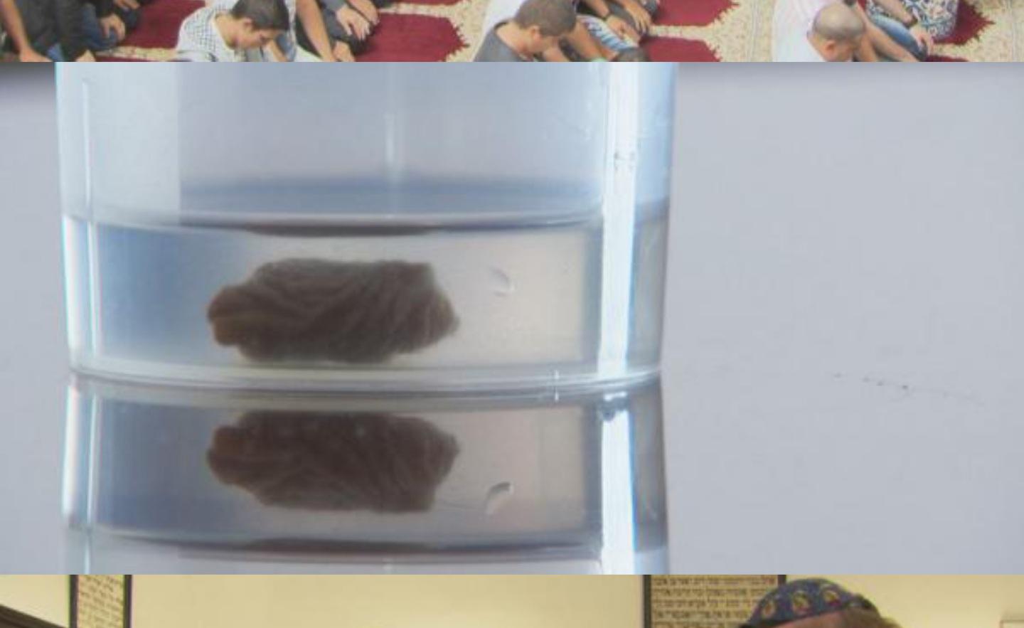 Has anyone preserved/had their parents preserve their circumcised Foreskin? | Scrolller