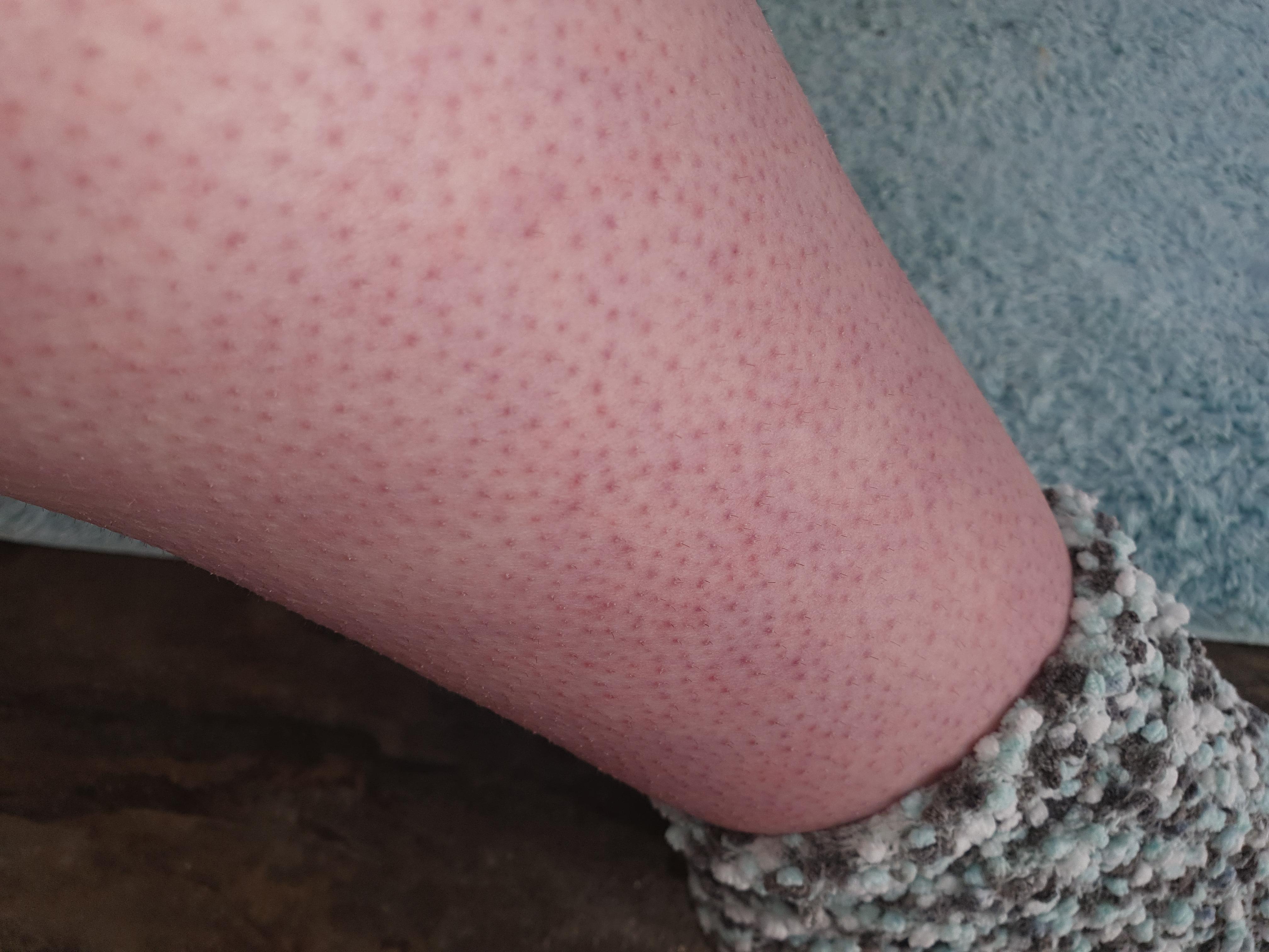 Help :( all suggestions welcome | Scrolller