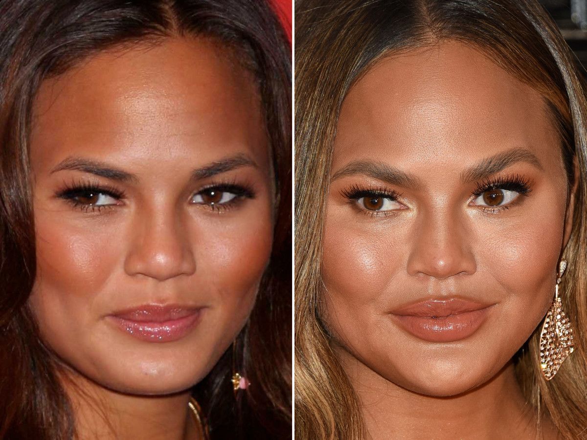 Her face was already so defined. She didn't need the filler | Scrolller