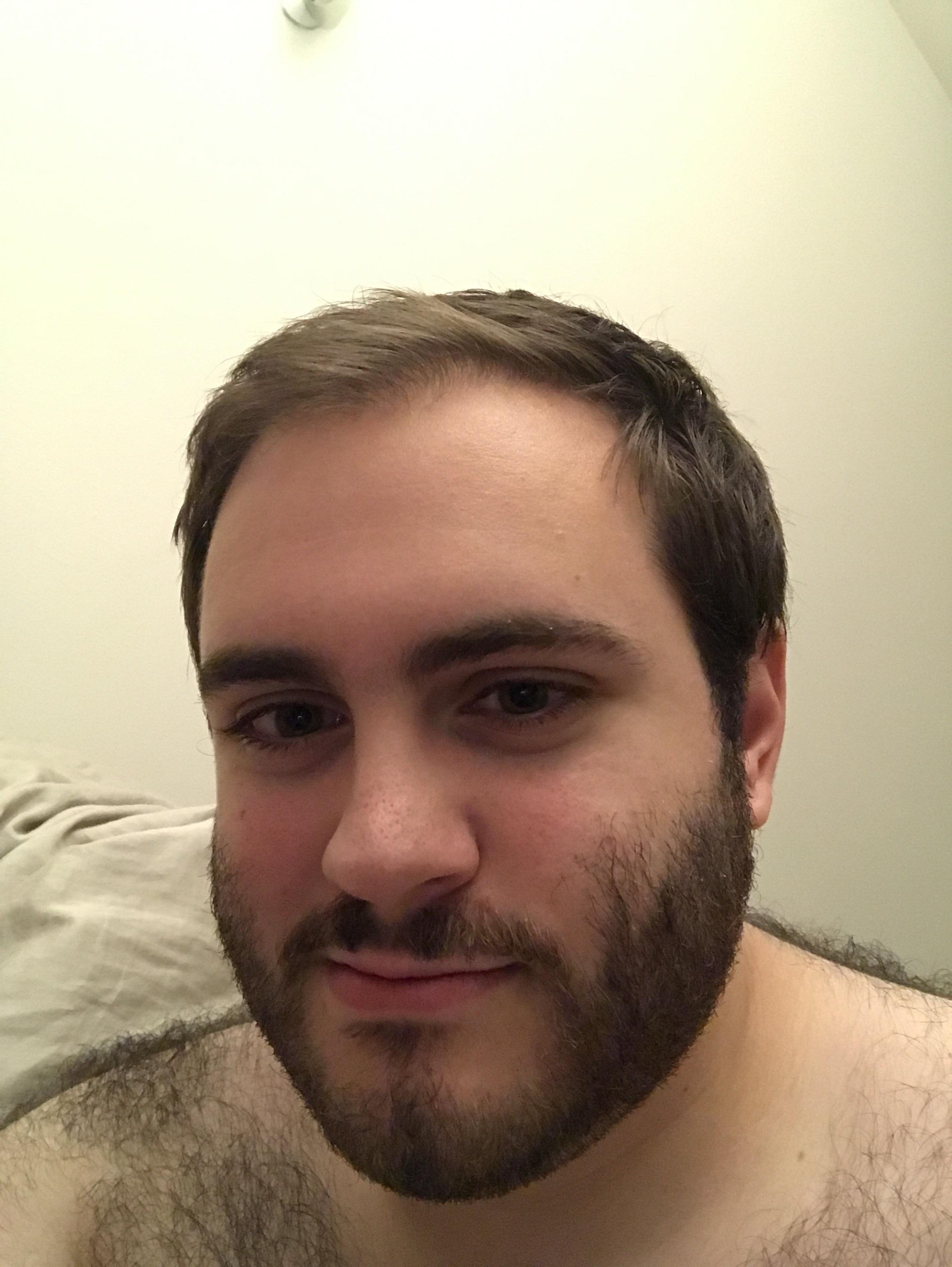 hey again!! | Scrolller