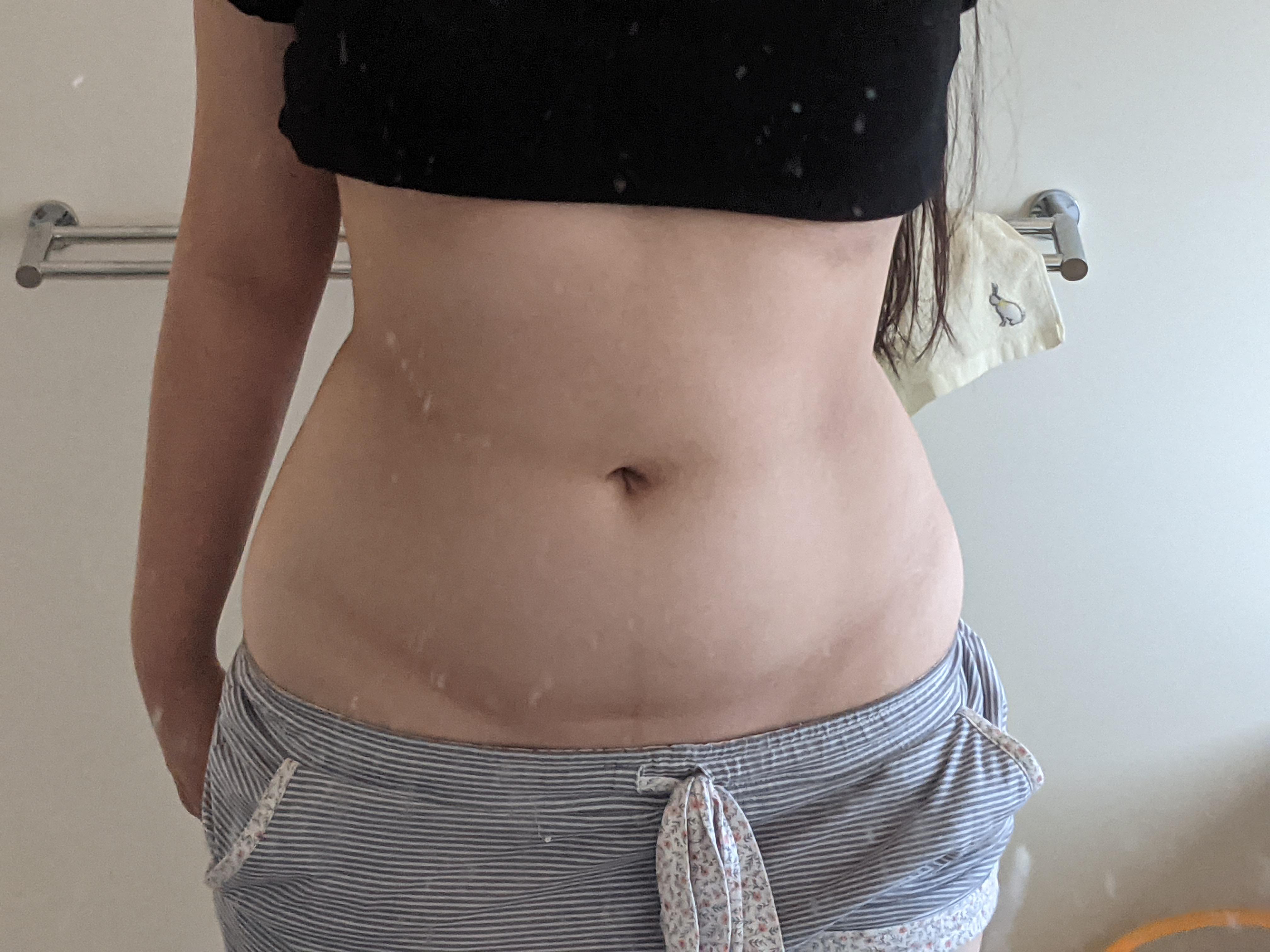 hi here is my tummy | Scrolller
