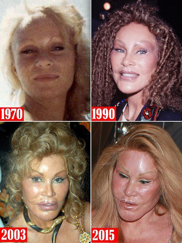 Honorable mention to Jocelyn Wildenstein | Scrolller Honorable mention to Jocelyn Wildenstein | Scrolller