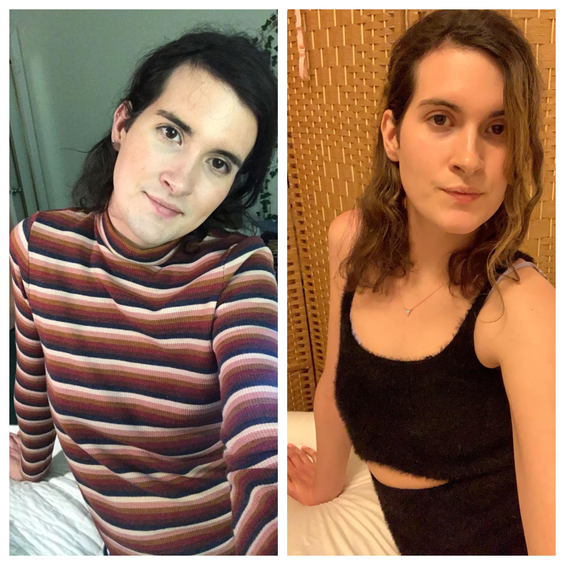 Hormones are remarkable, December 2019 vs December 2020 (18 months HRT total) | Scrolller