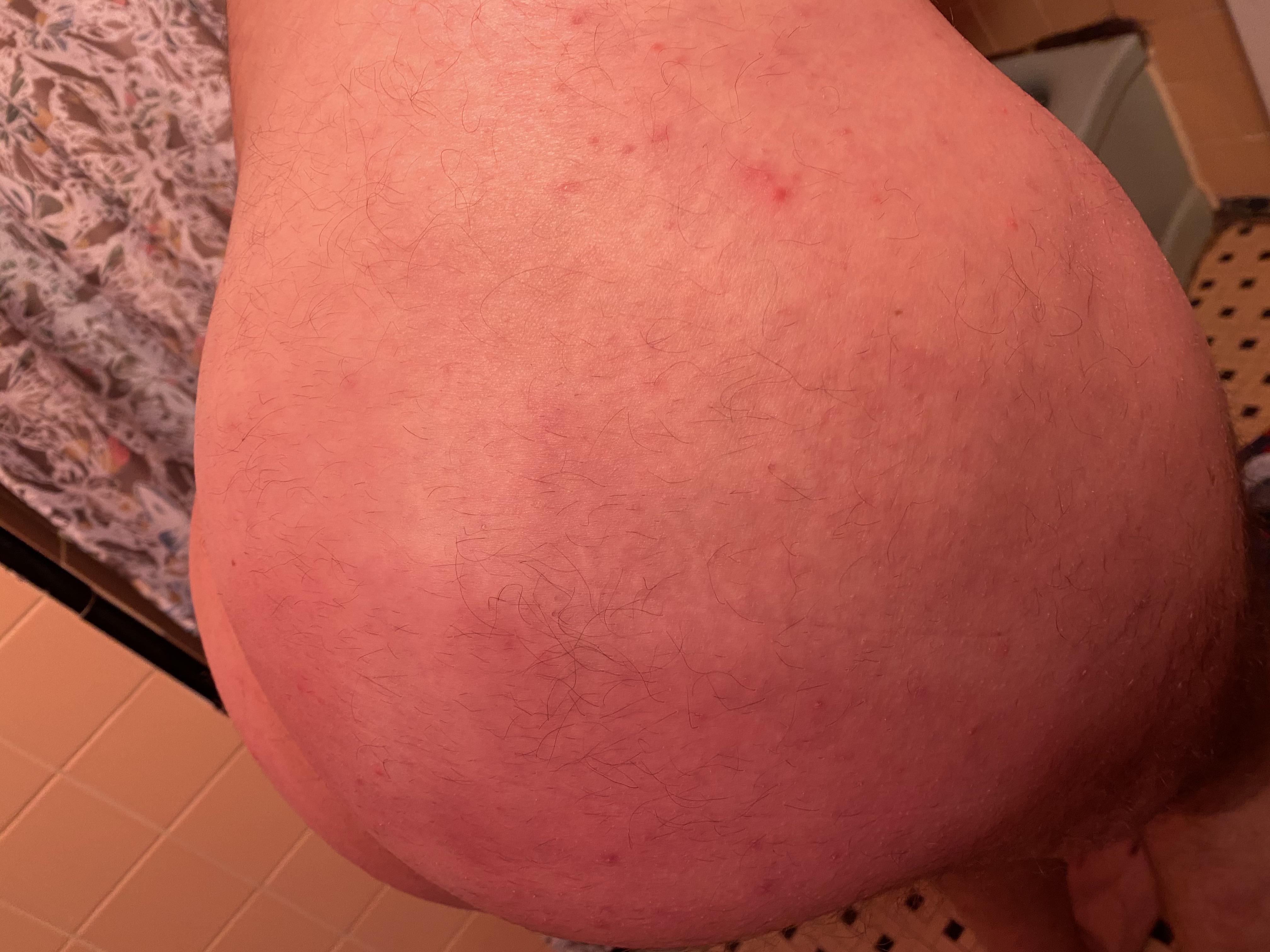 How is the shape?? | Scrolller