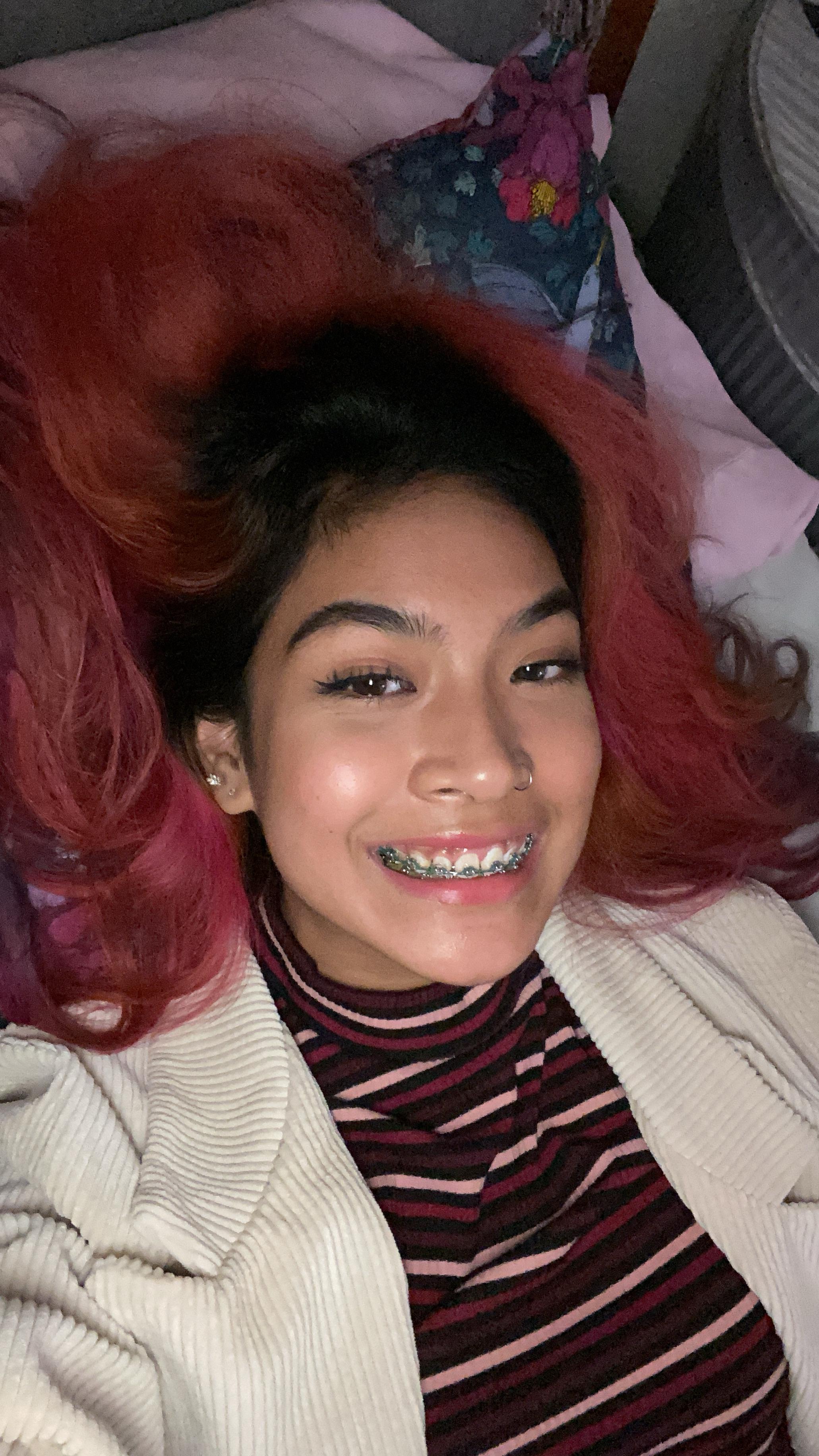 How you like my teeth? 😬 | Scrolller