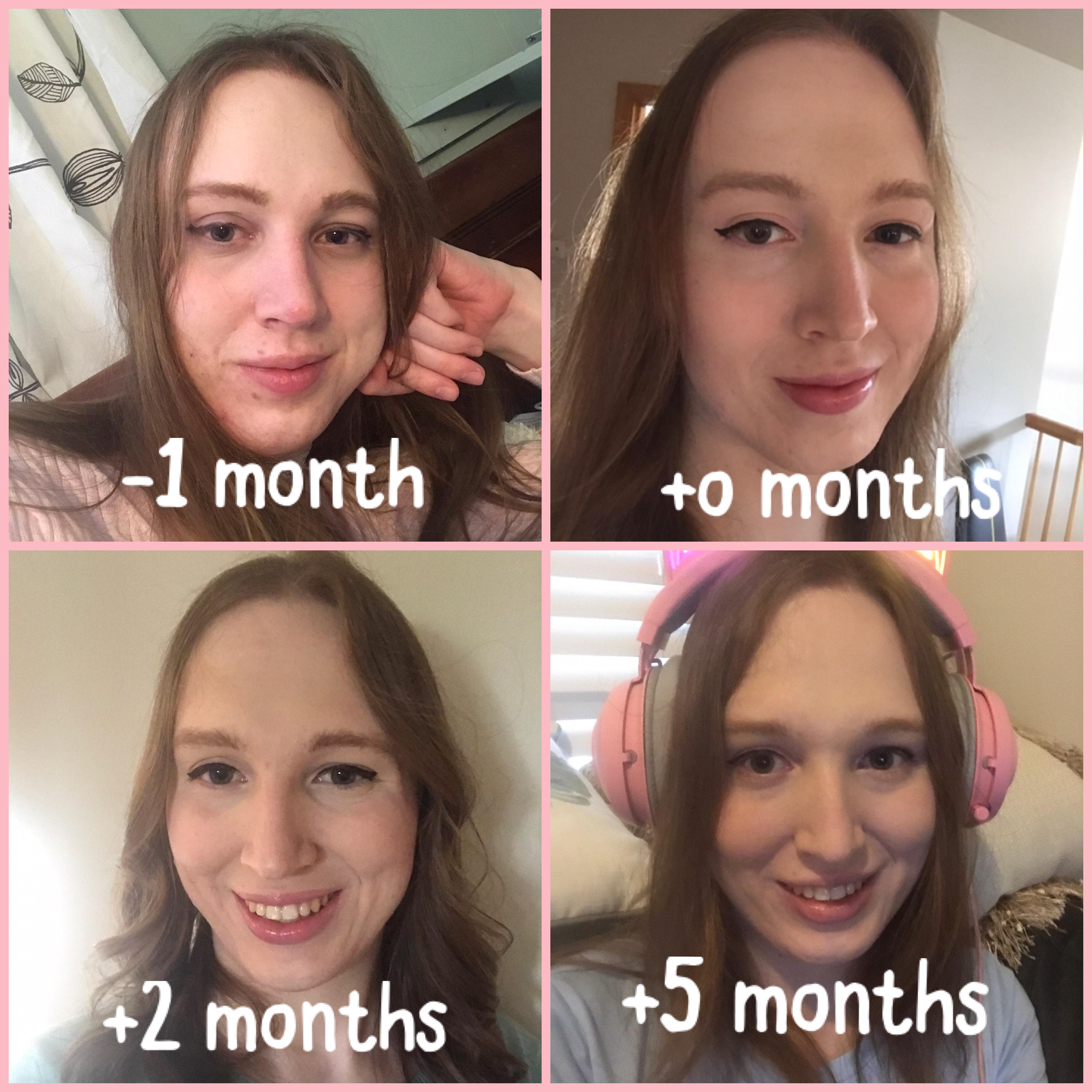 I didn’t realize how much I’ve changed until I saw these photos side by side 💝 (5 months hrt, no ...