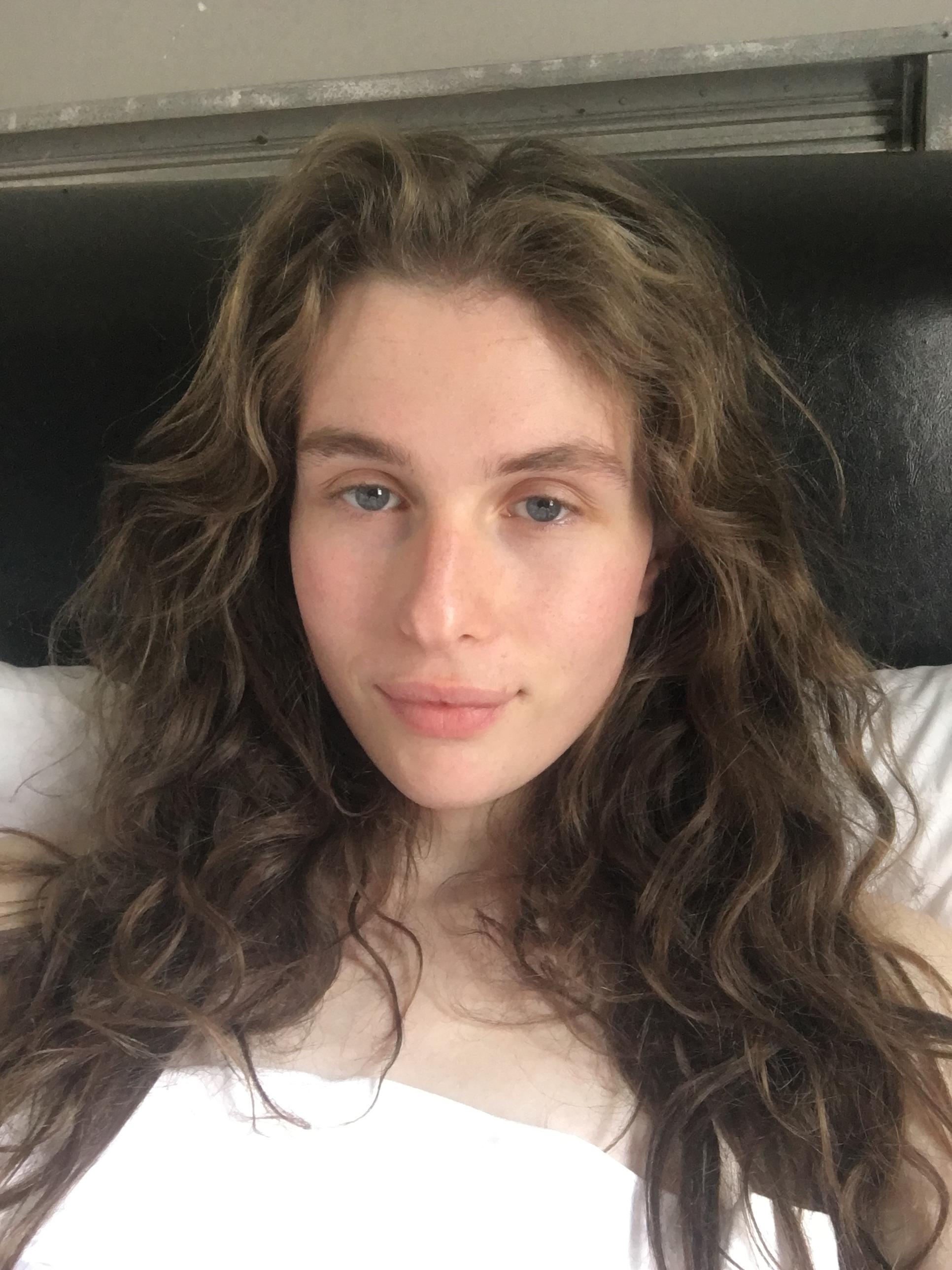 I don't have before pics, I hated my face "before" This is what half a decade on hormones gets ...