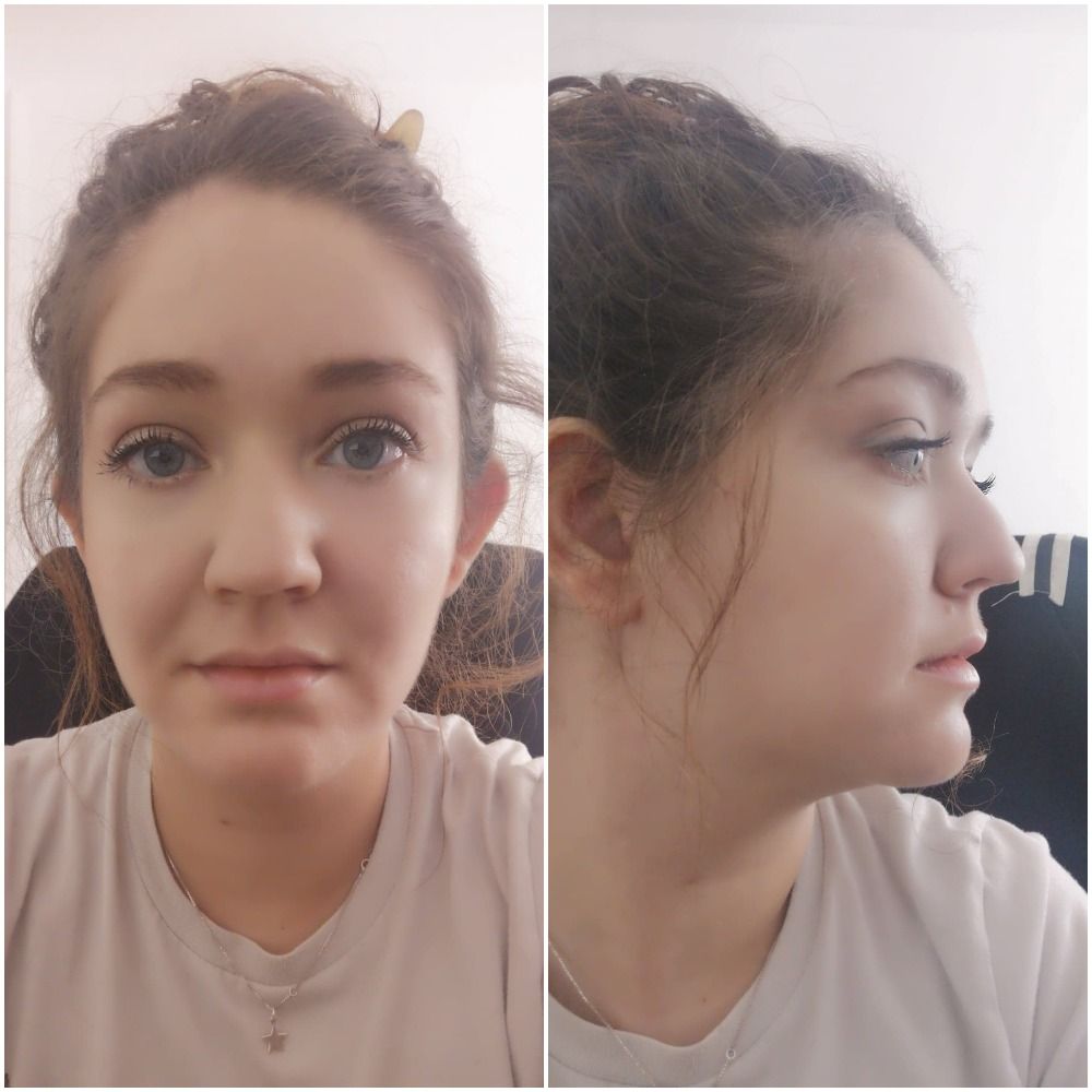 I hate my nose, I think it's so huge, prominent and crooked. I'm trying ...