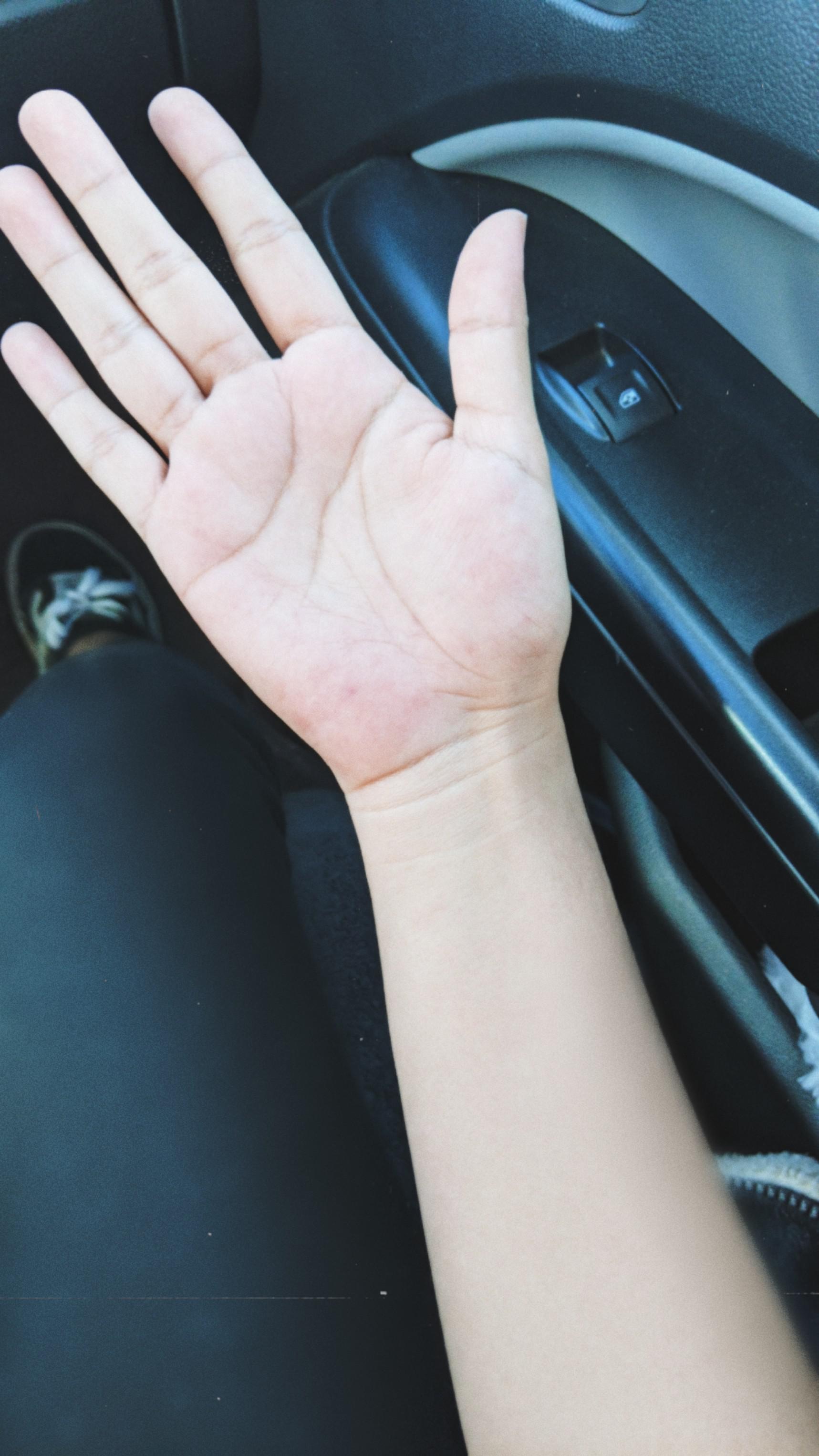 I have square palms lol | Scrolller