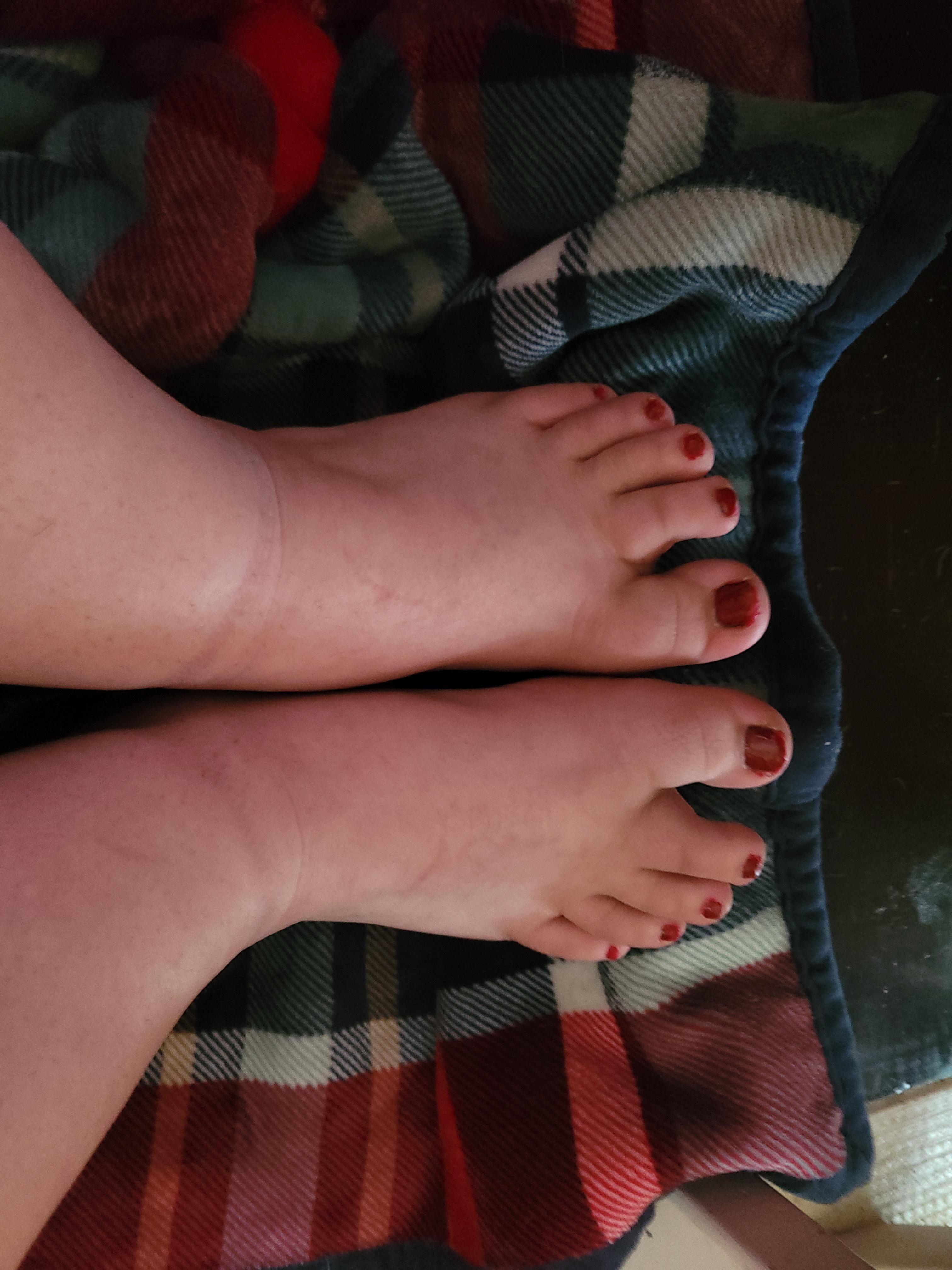 My chubby little piggies. ,😍 | Scrolller