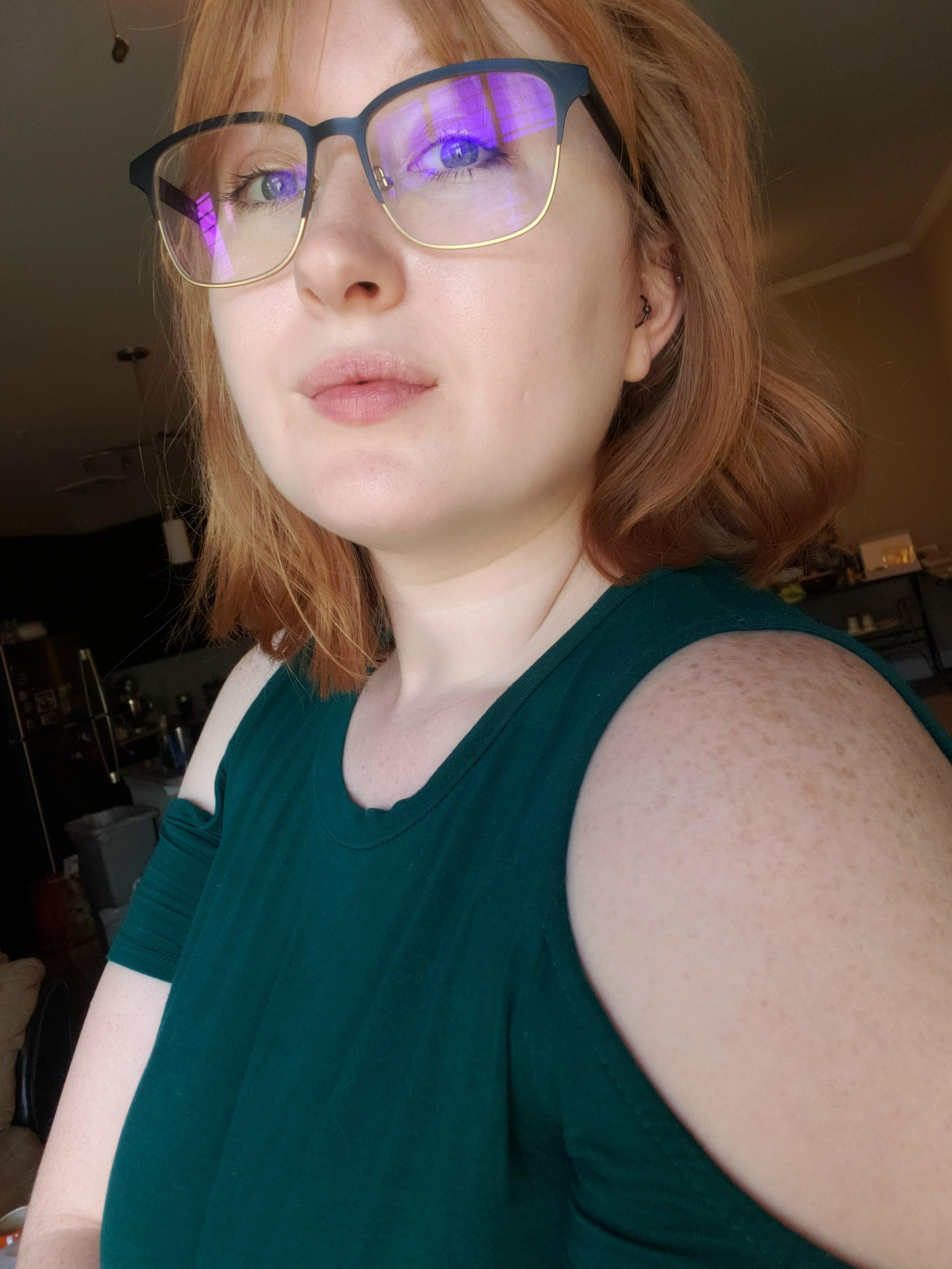 I used to hate my red hair, freckles and pale skin but now I can't ... I used to hate my red hair, freckles and pale skin but now I can't ...