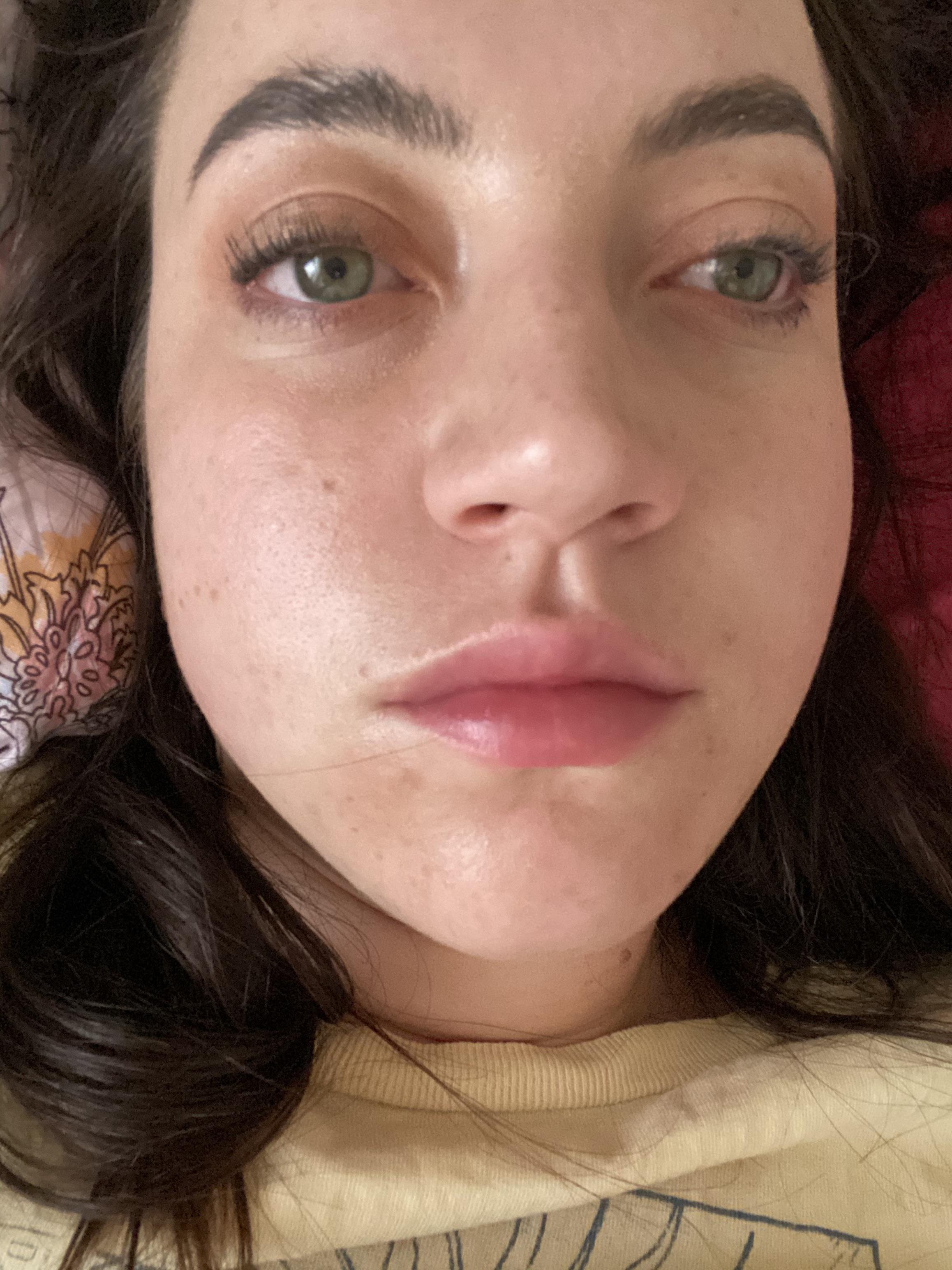 I Was Trying To Take A Photo Of My Sleepy Lazy Eye To Send To A Friend But They Looked Extra