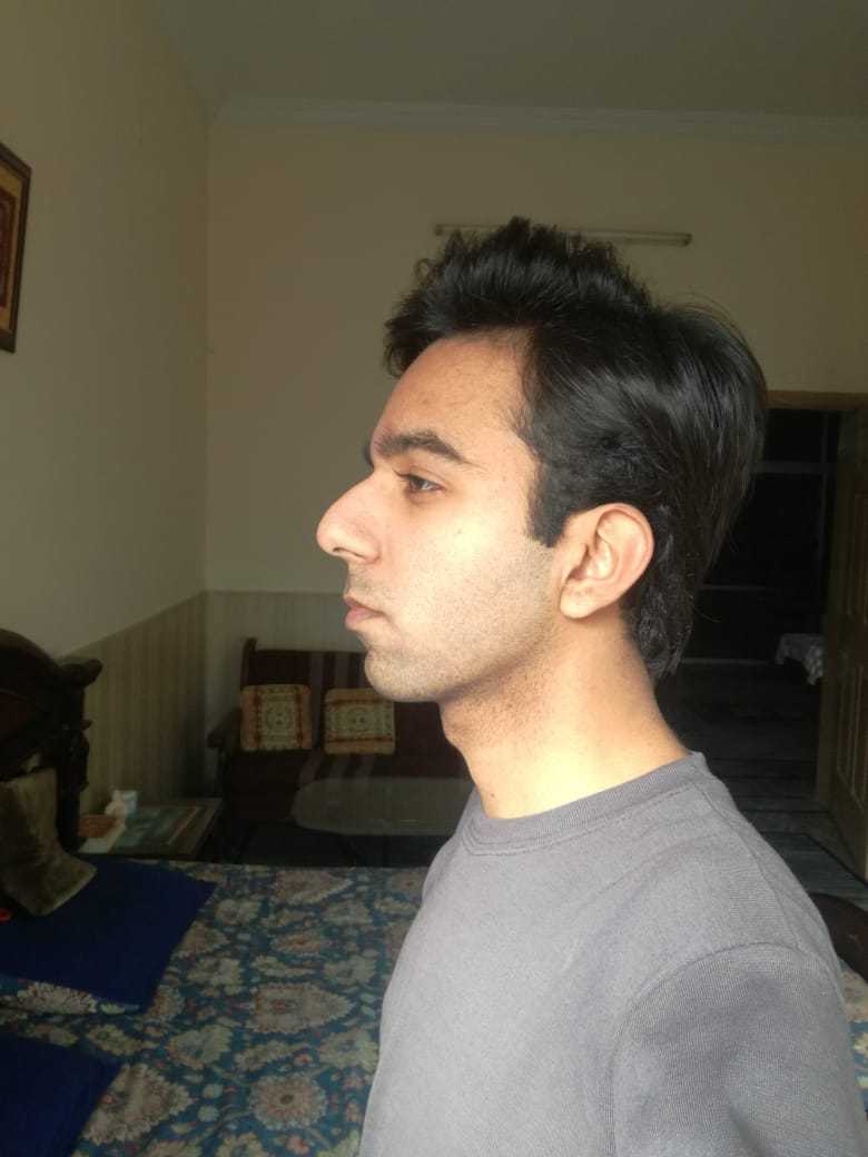 Is my chin recessed? | Scrolller