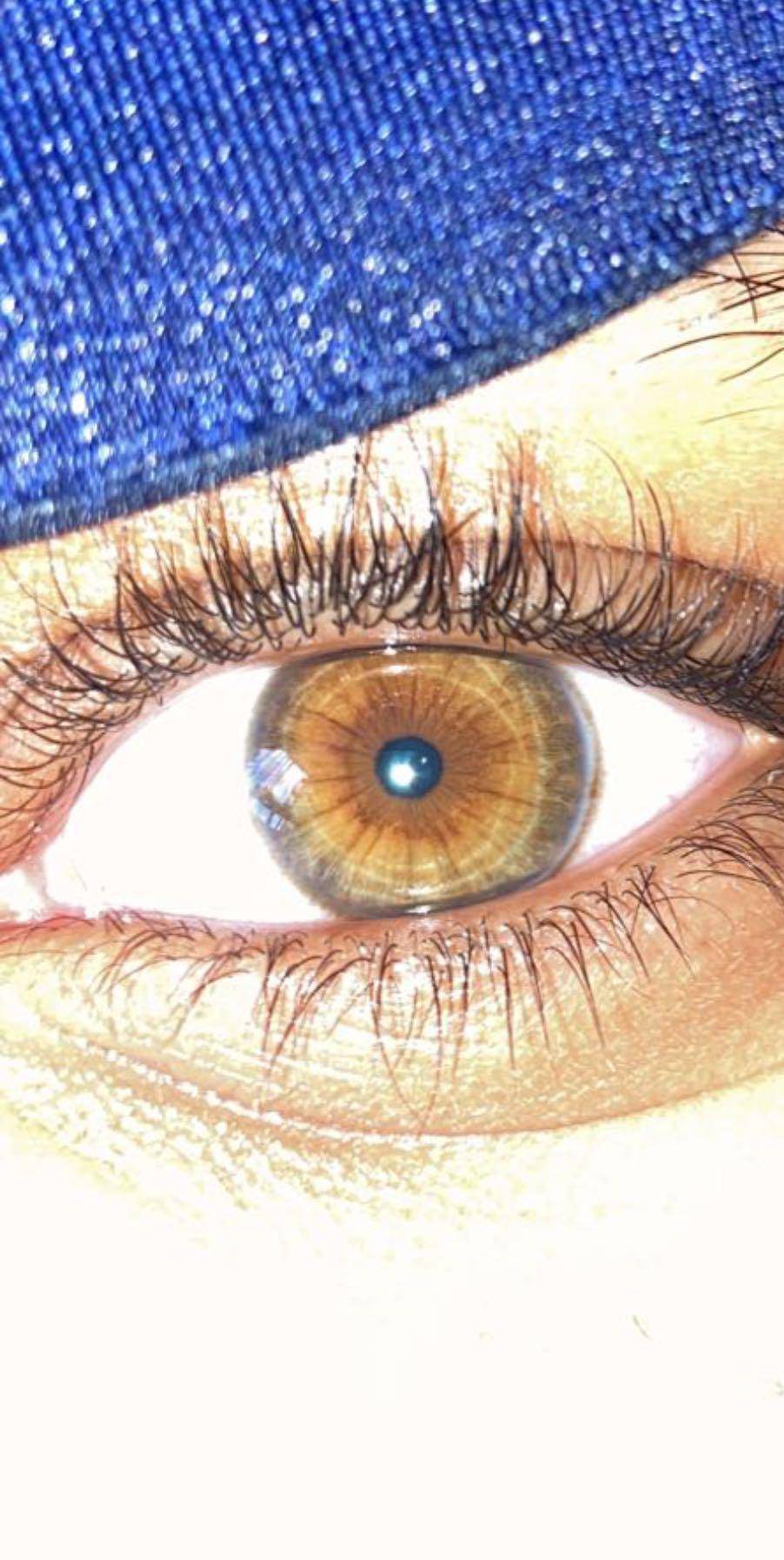 Is this Central heterochromia or hazel eyes? | Scrolller