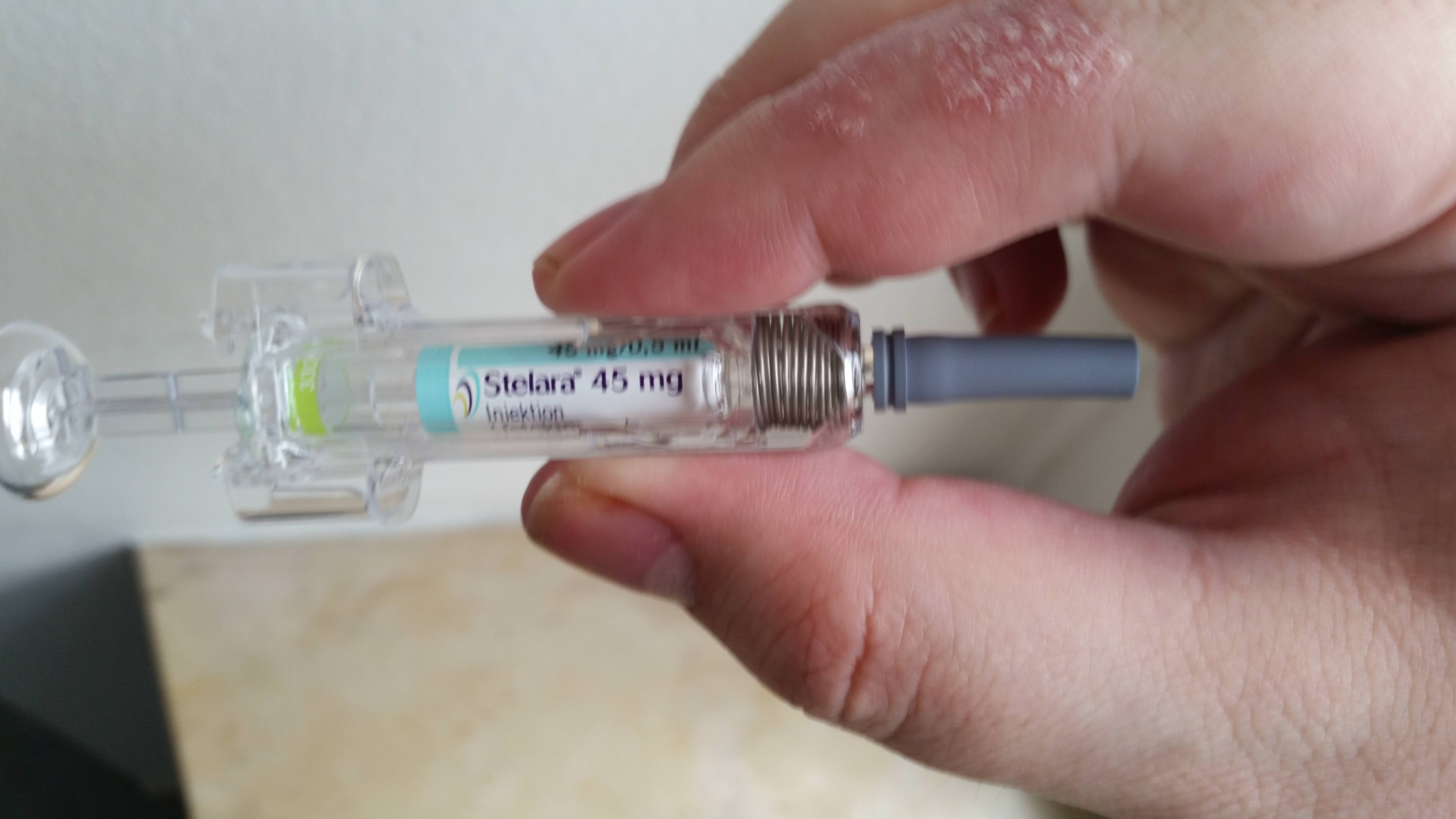 It begins | Scrolller