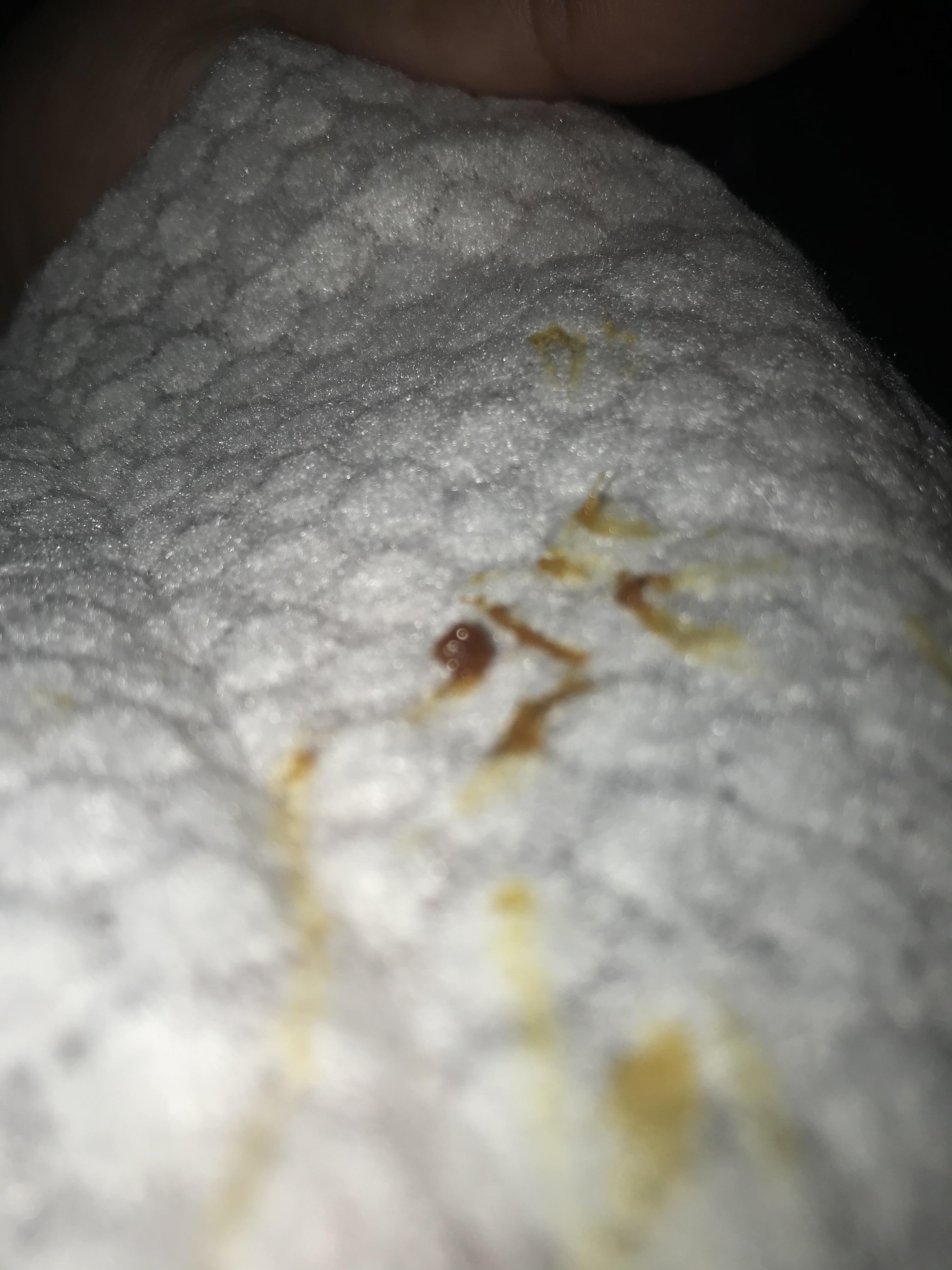 It was real satisfying using the “LEGENDARY” tool called Bobby pin to remove some ear wax ...