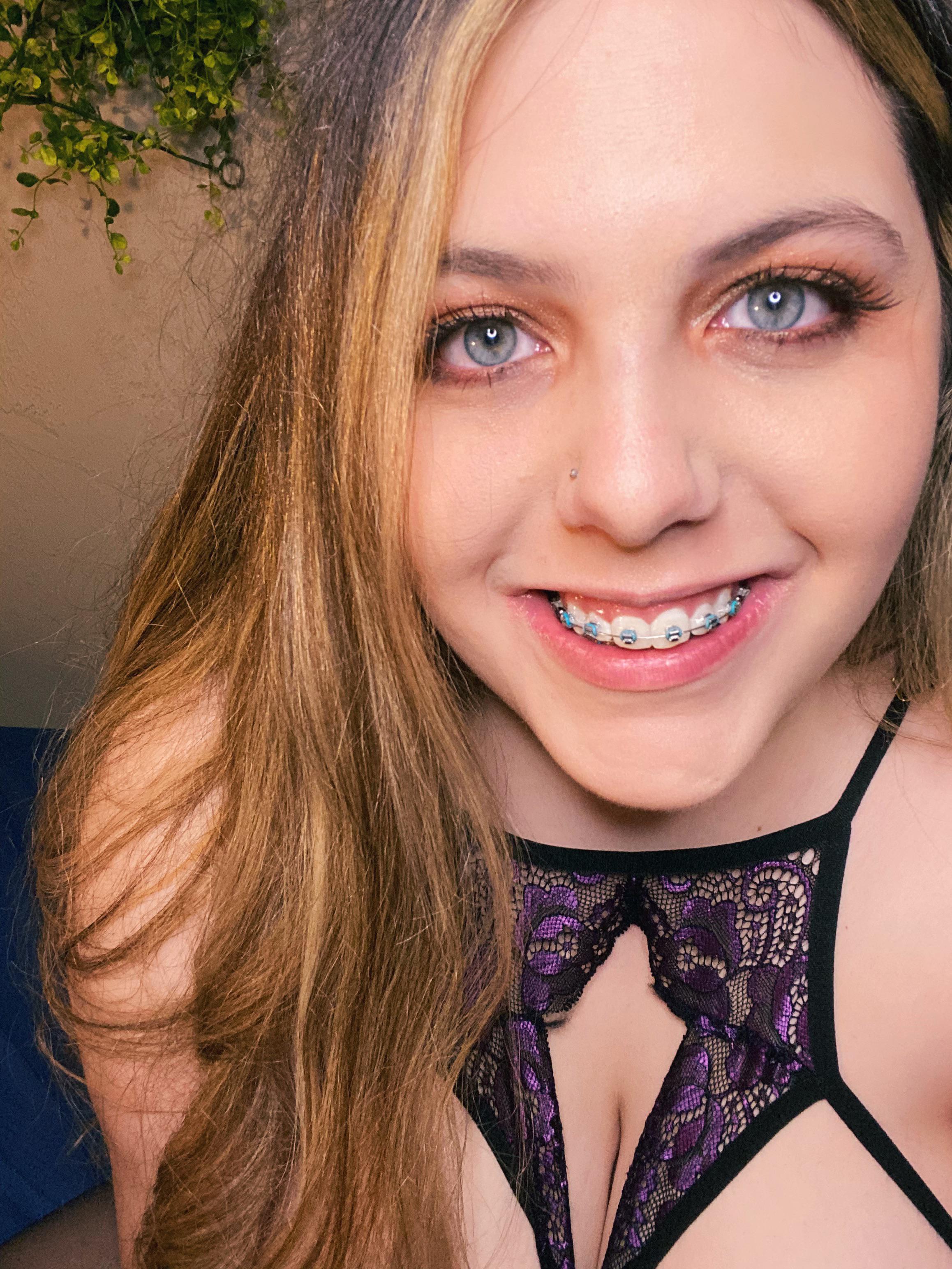 Just another OnlyFans slut with braces 😉 | Scrolller