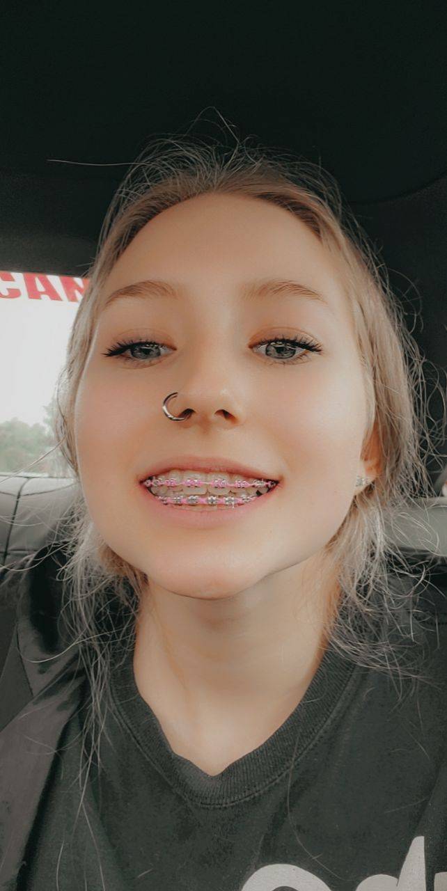 Just got my colors changed | Scrolller