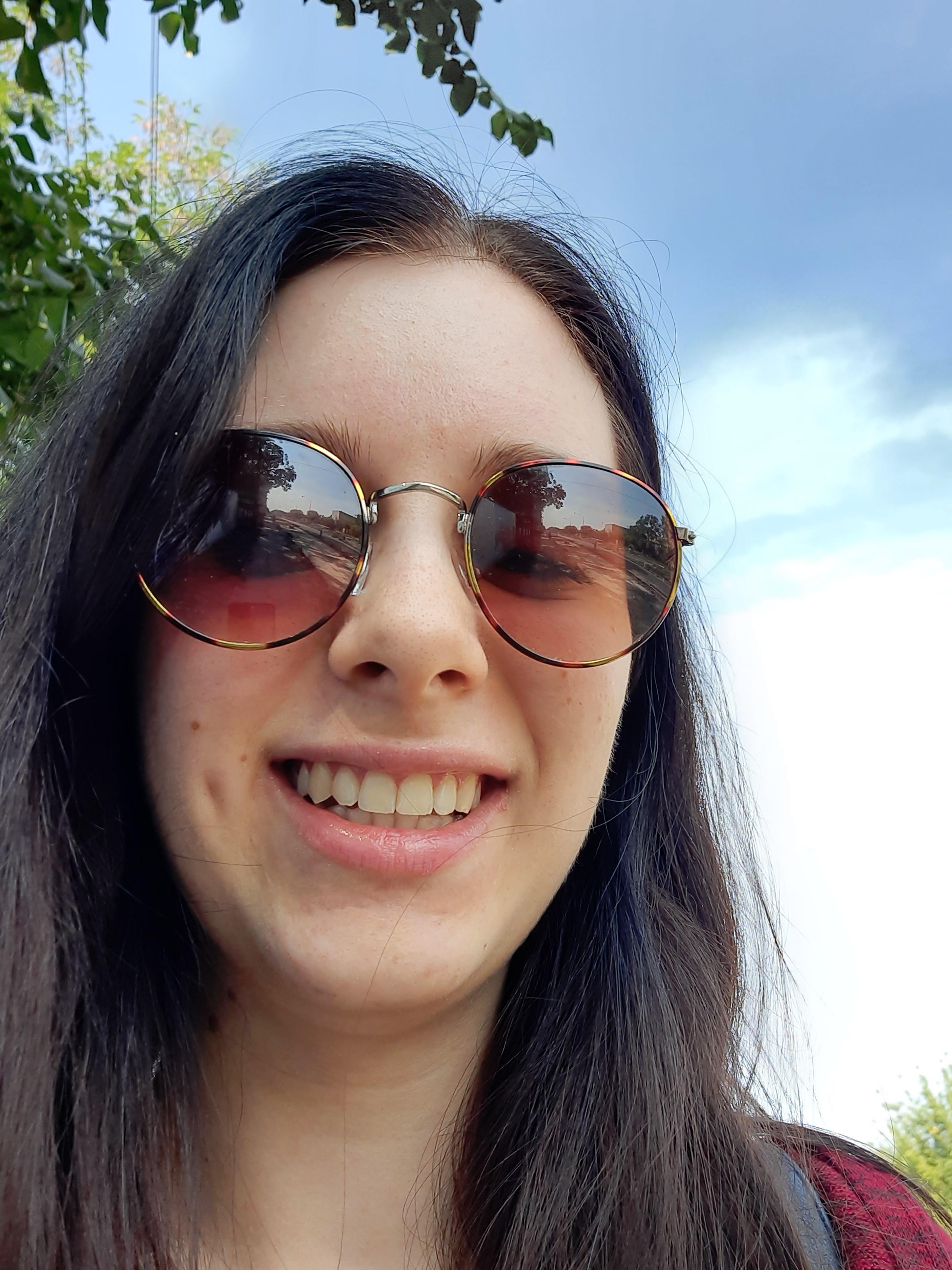 Just got them off! So happy | Scrolller