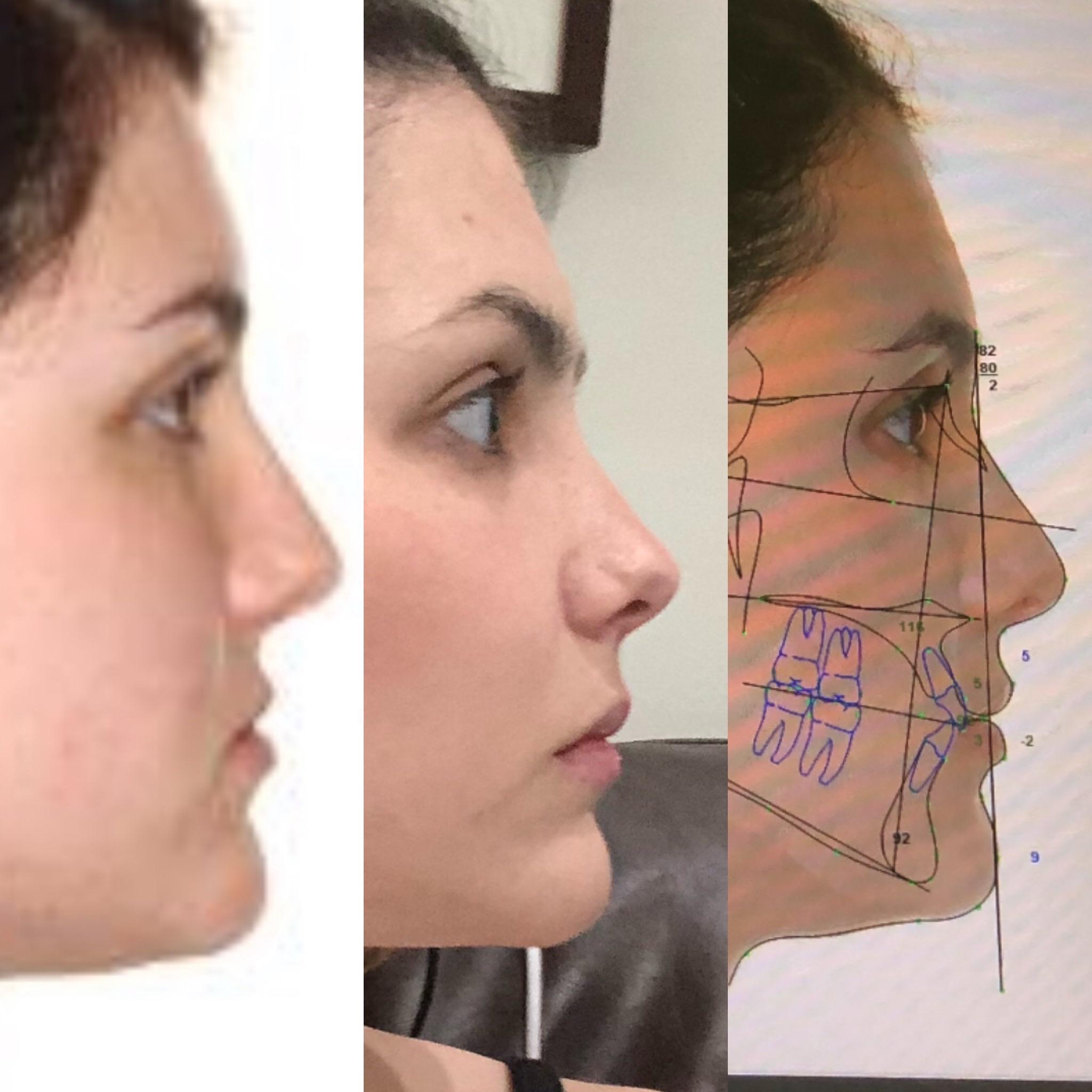 Just in case you wanted to see how close projections are to the final result (Before/5 Weeks ...