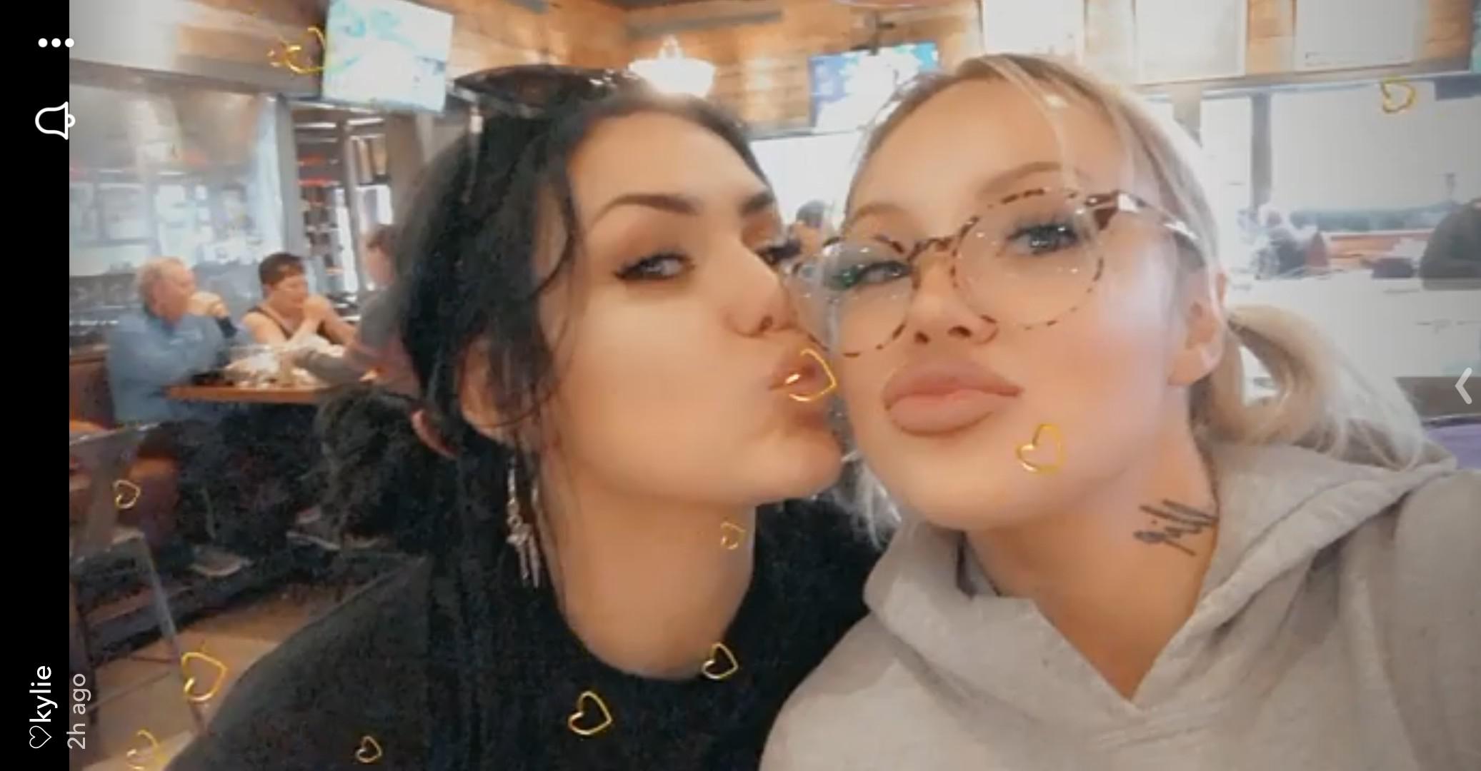 Kylie's new lips after injections yesterday | Scrolller