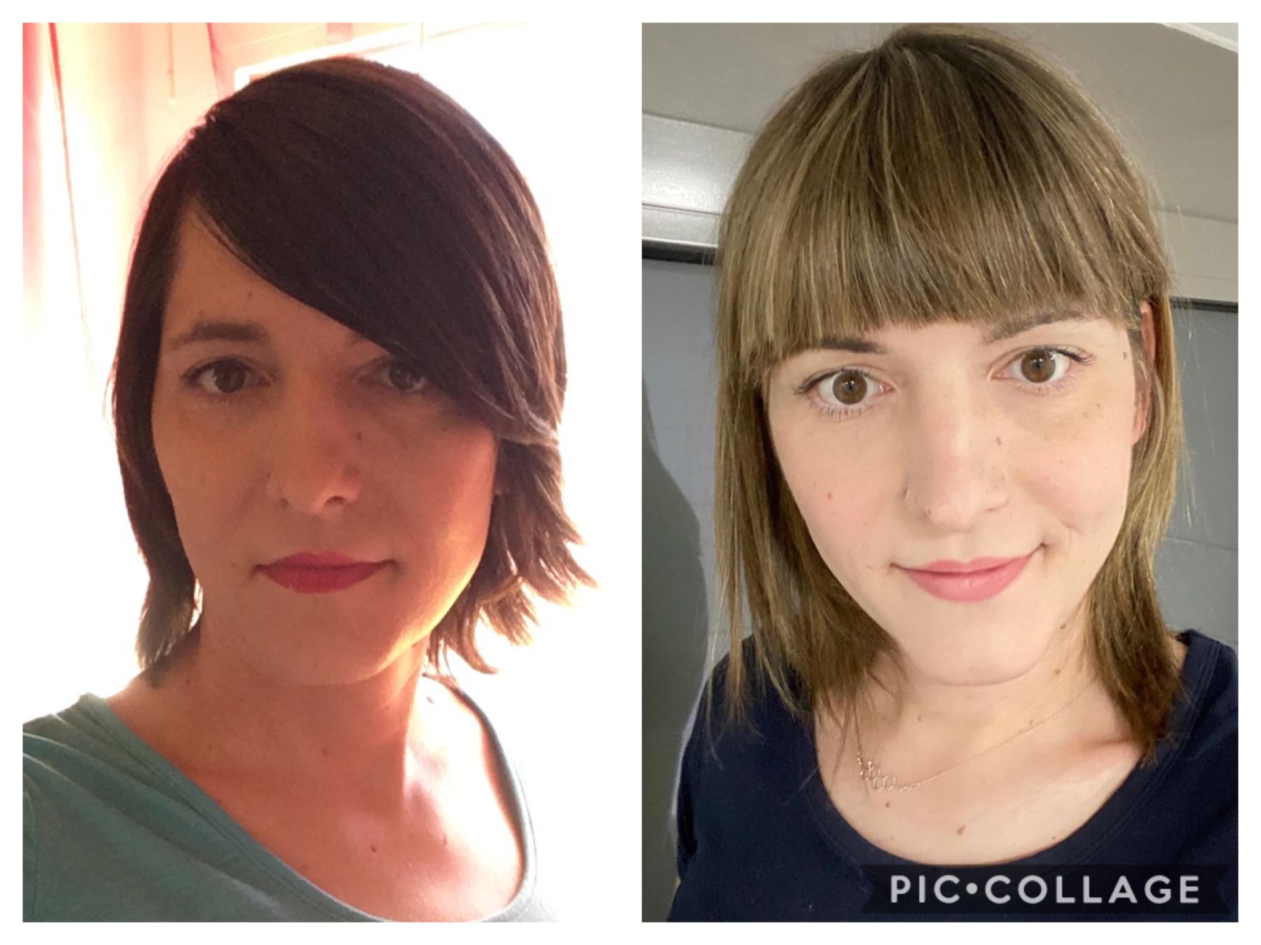 Left 10 months HRT, right 22 months HRT. Remember, it takes time. 41yo | Scrolller
