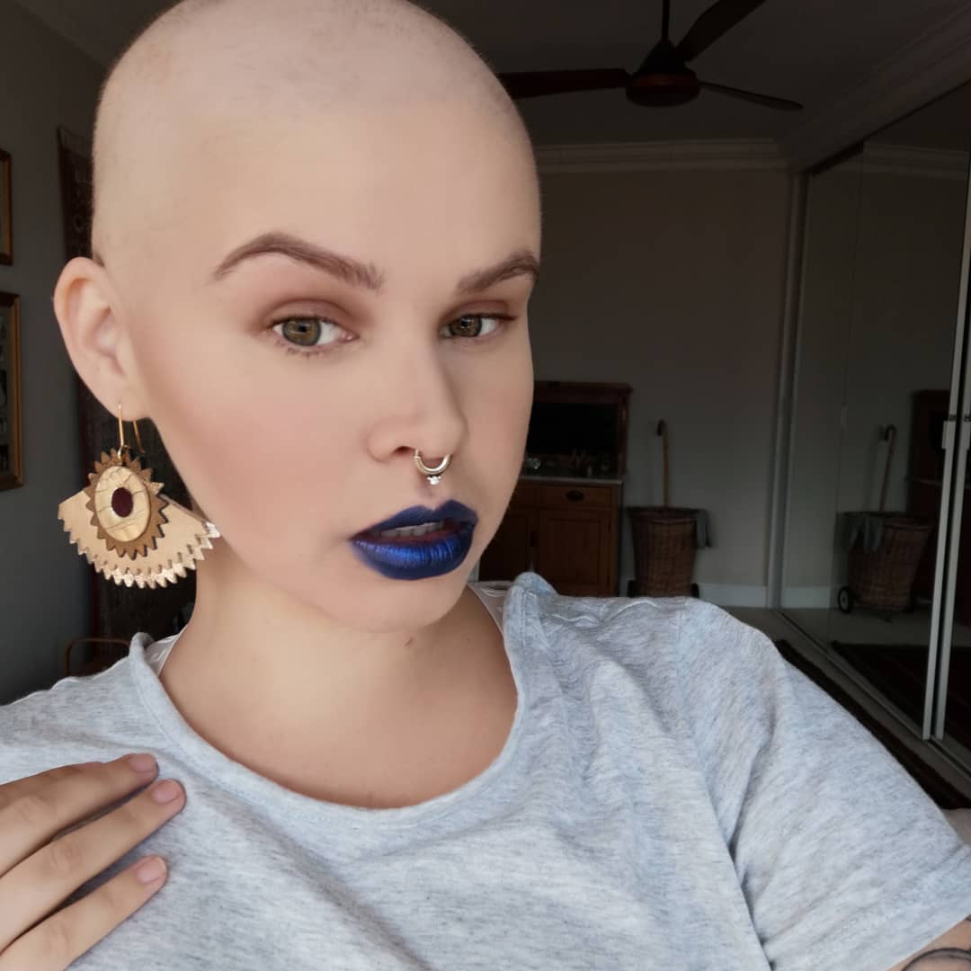 Lost my hair to chemo but now I wish I shaved my head YEARS ago! | Scrolller