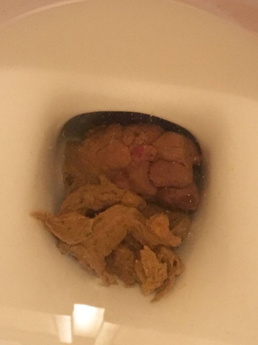 Made my butthole bleed | Scrolller