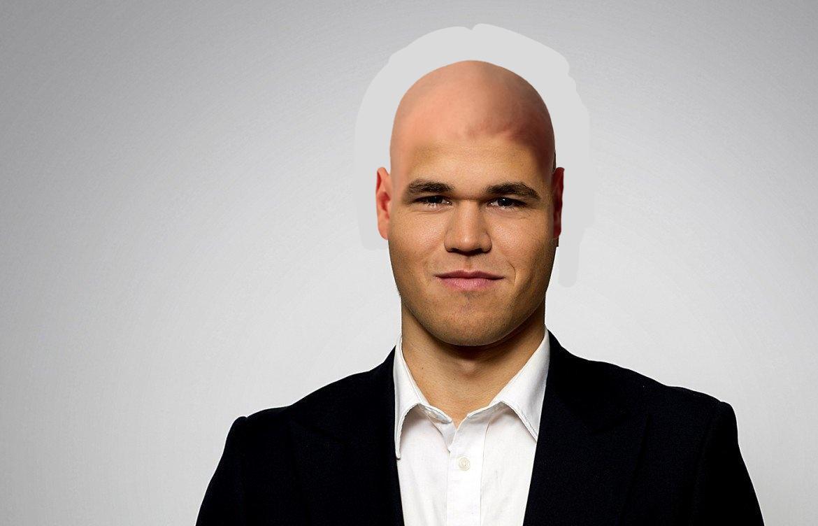 Magnus is a bald fraud | Scrolller